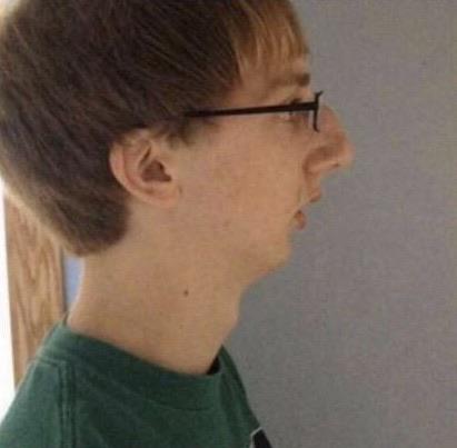 Mewing 12 hour progress, side profile lookin kinda strong ngl 😳 | Scrolller