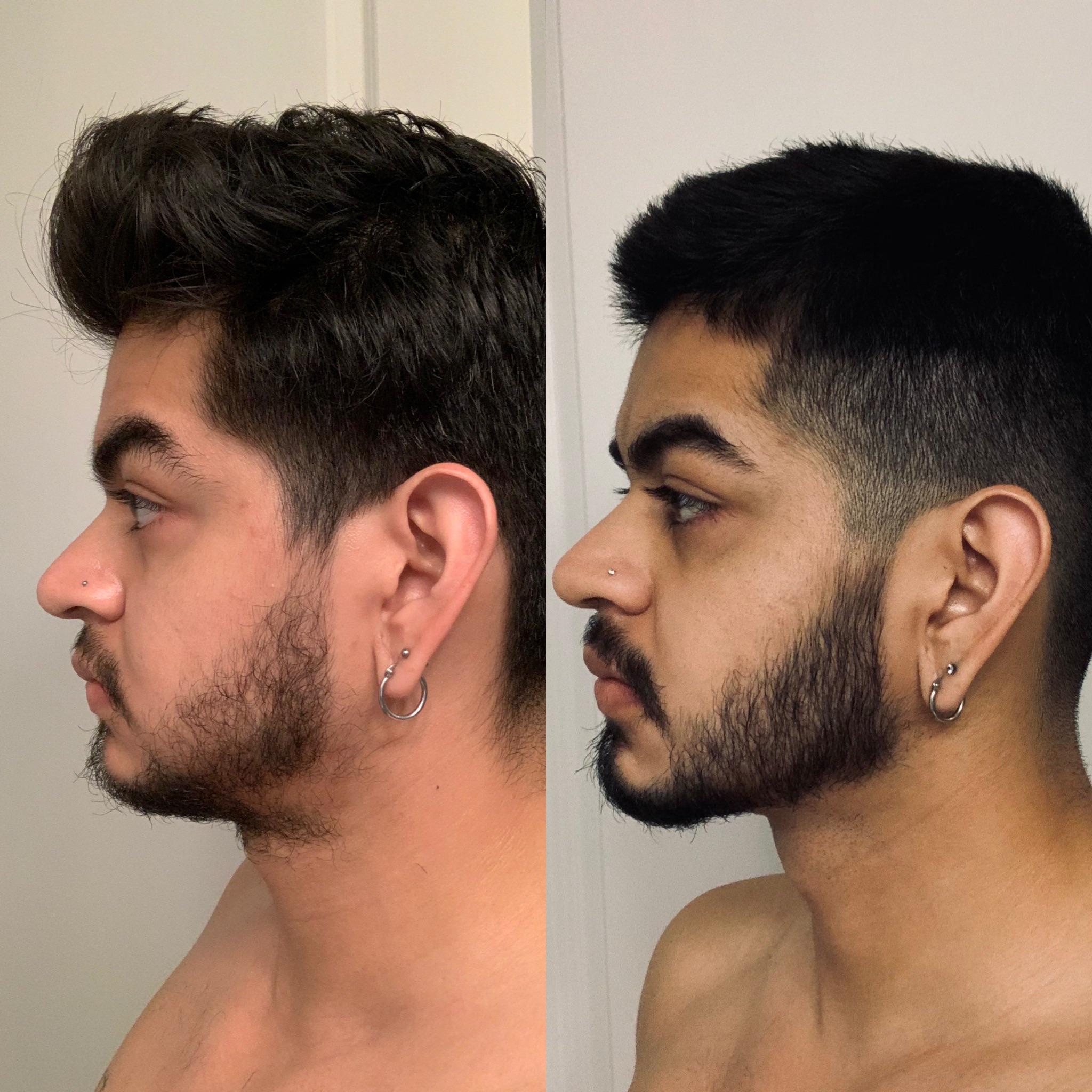 Mewing progress shot that unintentionally became a minox one | Scrolller