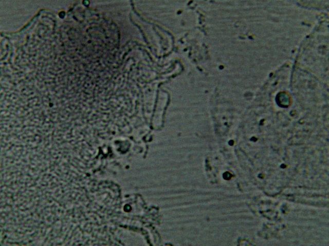 Microbe/cell identification community | Scrolller