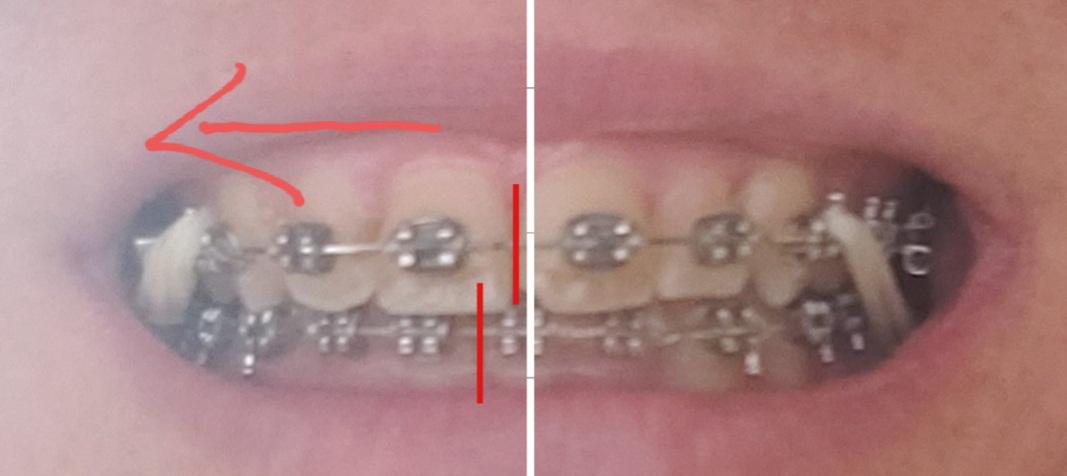 Midline concern (question in comments) | Scrolller