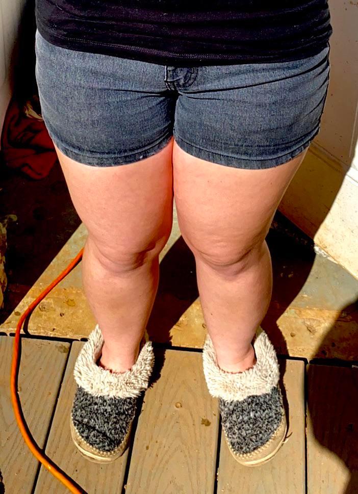 Mom legs | Scrolller