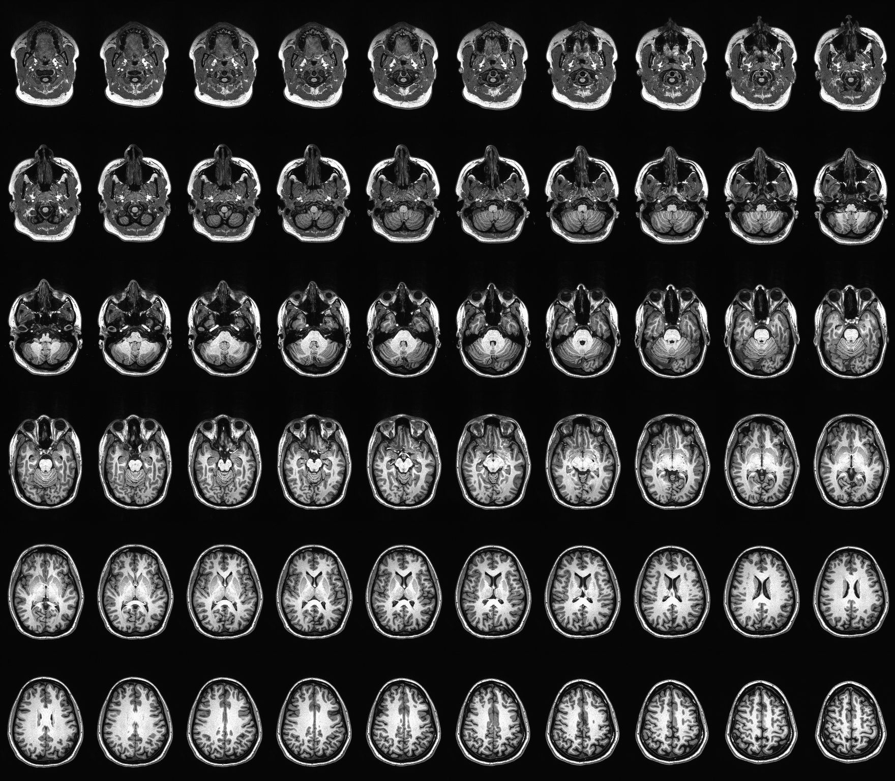 My brain's MRI | Scrolller