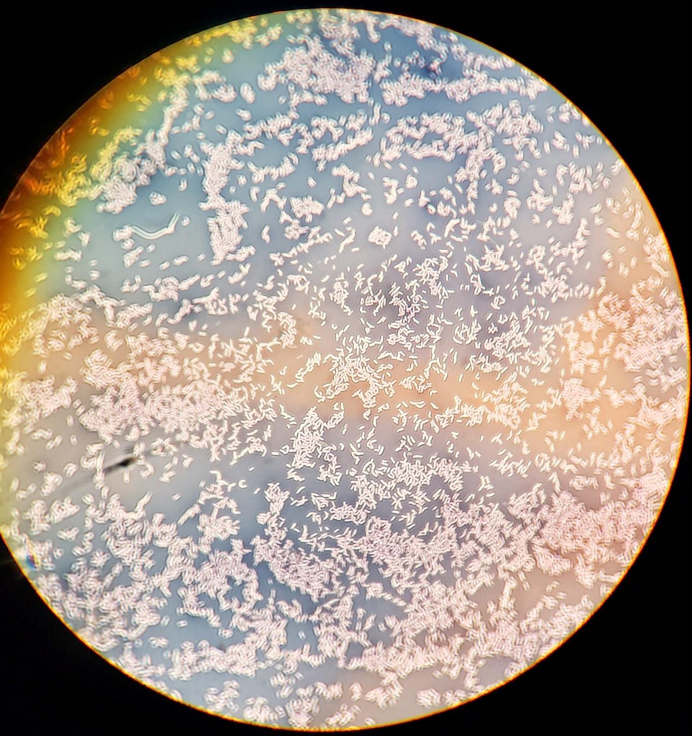 My capsule stain of bacteria at 1000x total magnification! | Scrolller