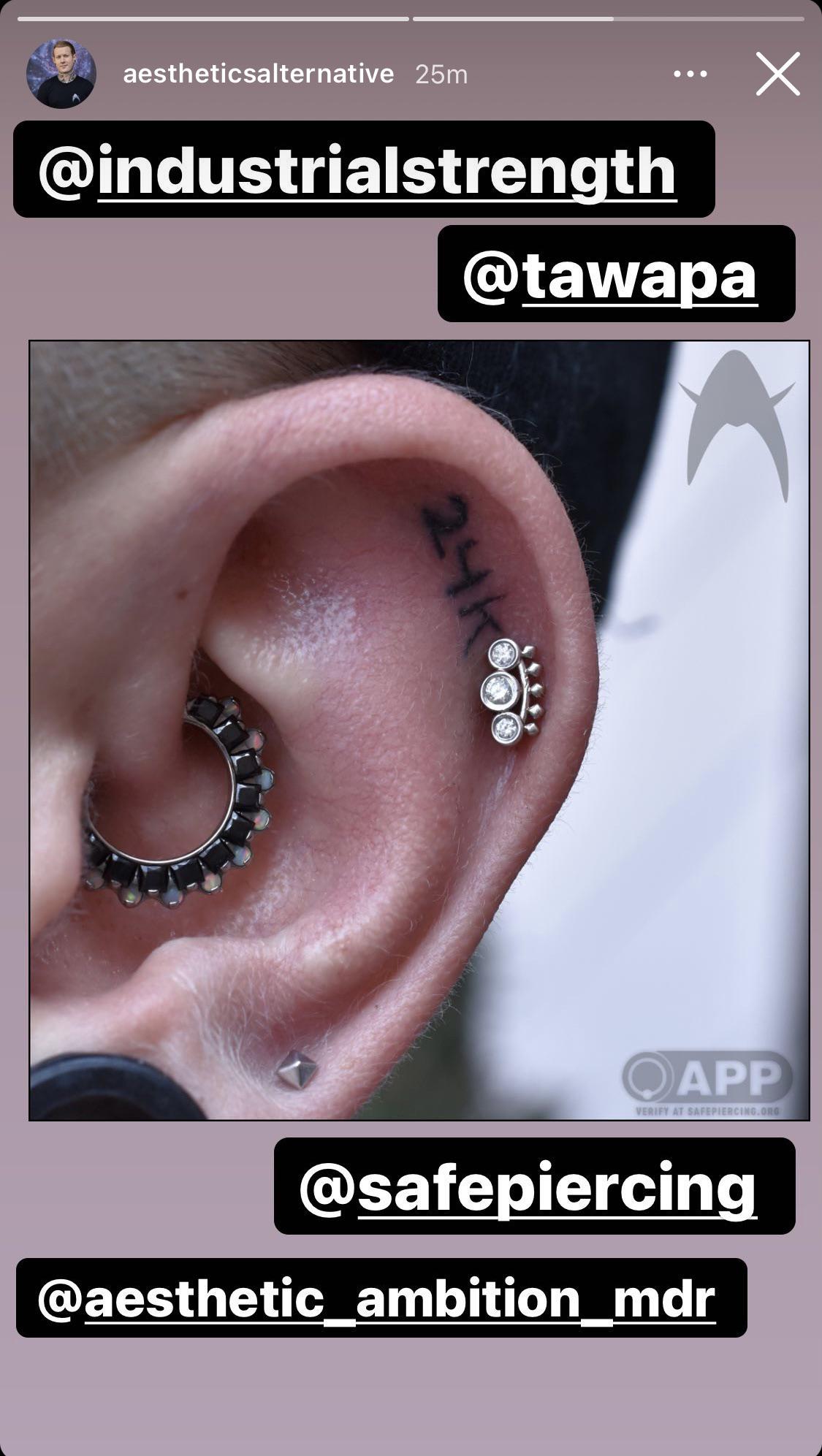 My Ear 🥶 | Scrolller