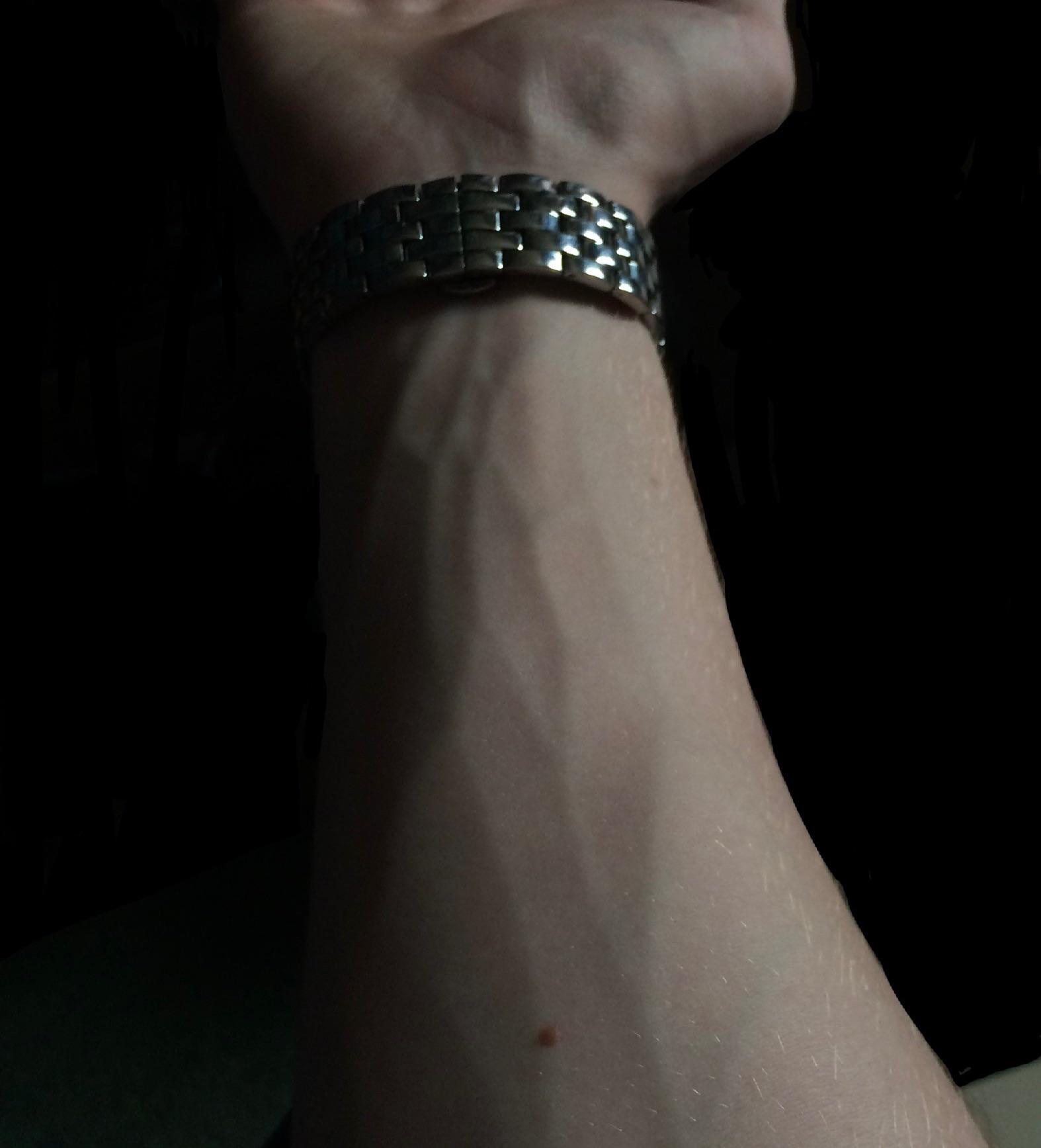 My forearms at rest | Scrolller