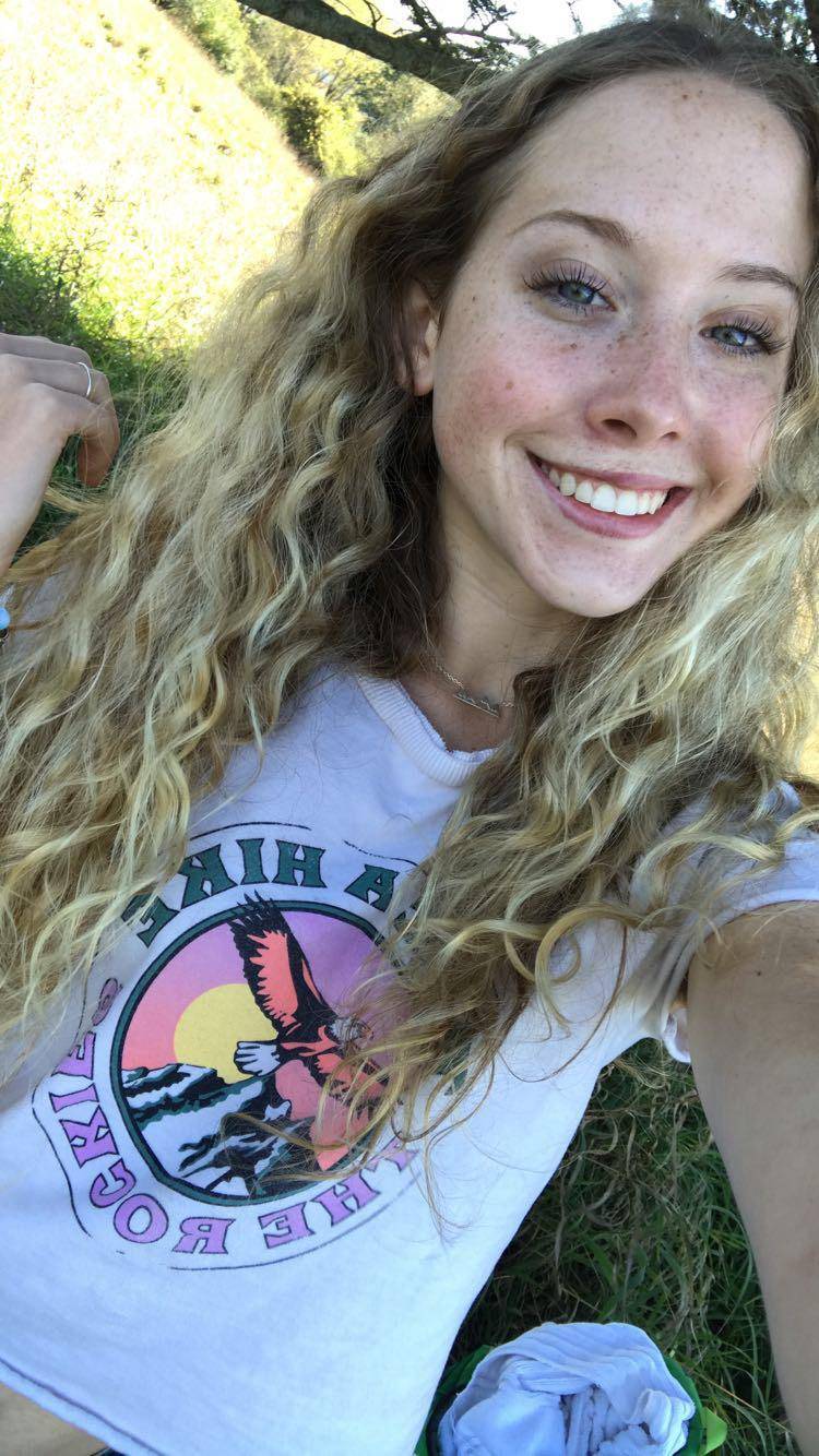 My Freckles Poppin In The Summer Sun π Scrolller