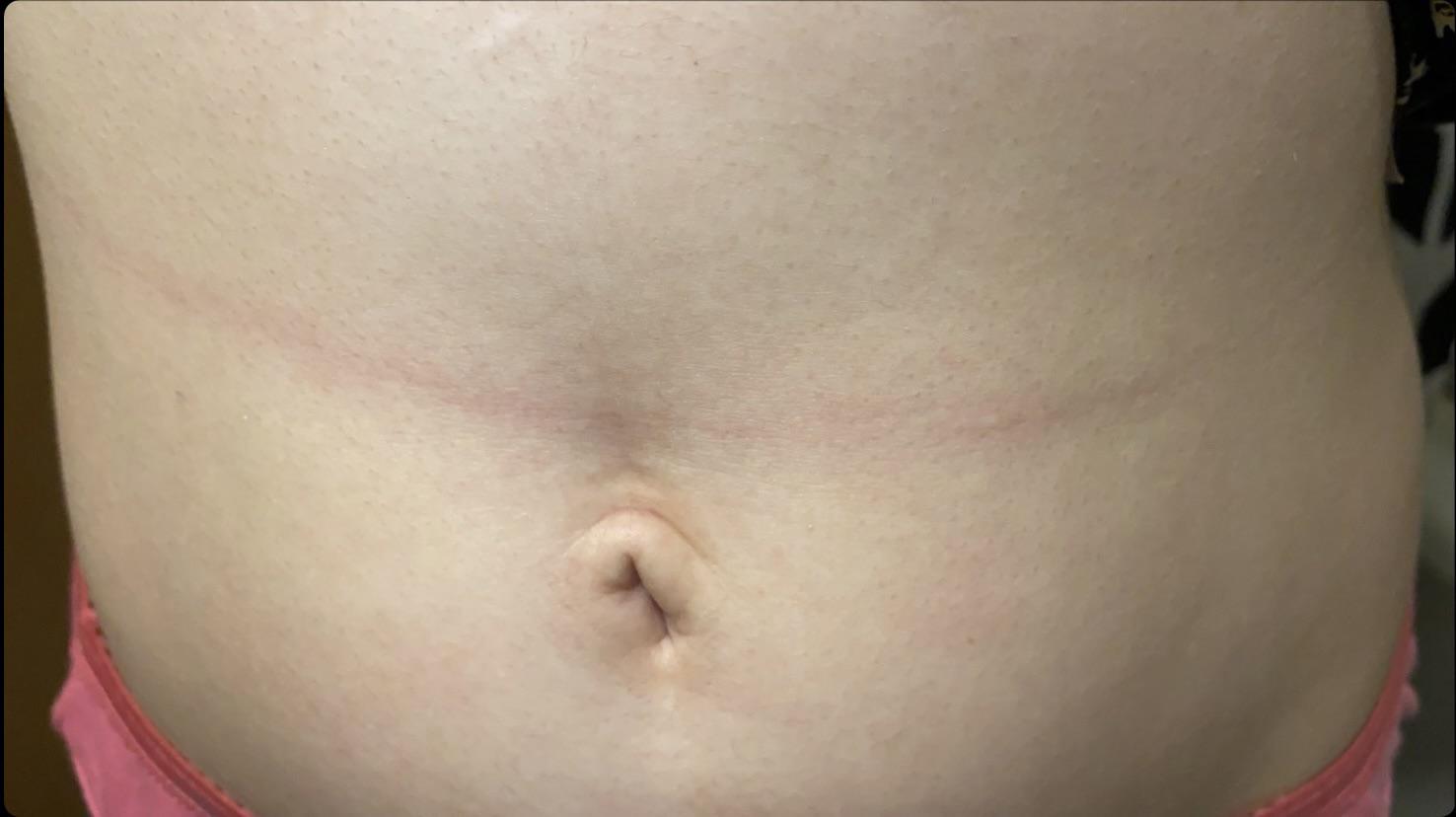 My gf belly button | Scrolller