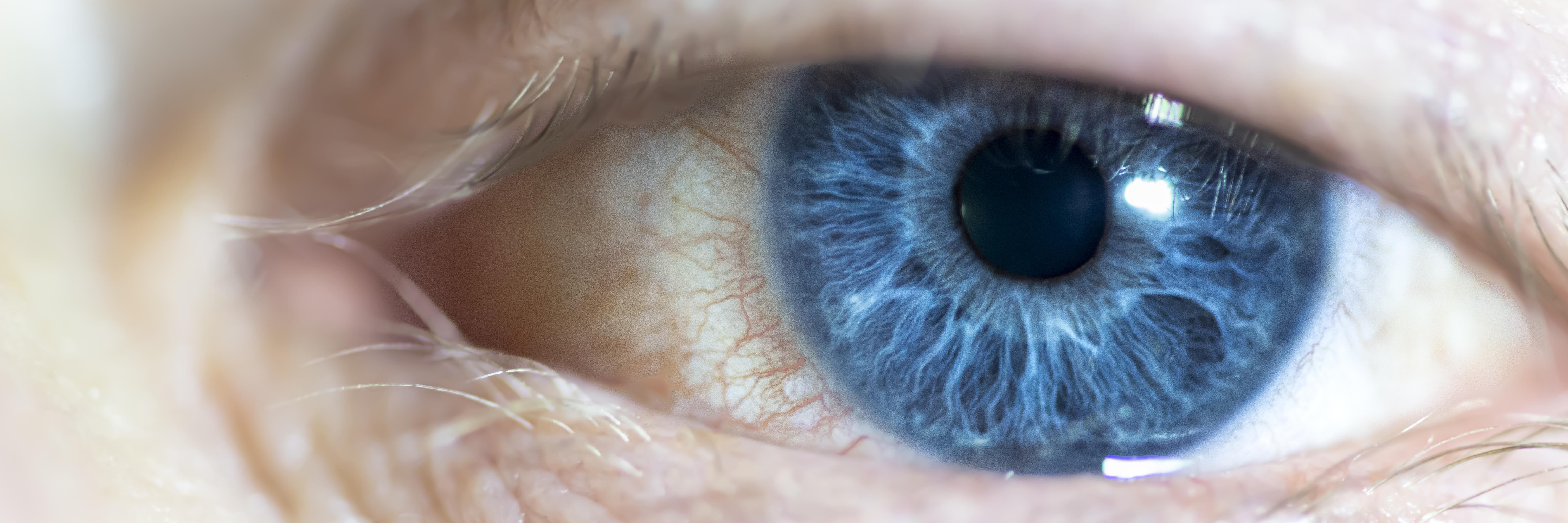 My left eye | Scrolller