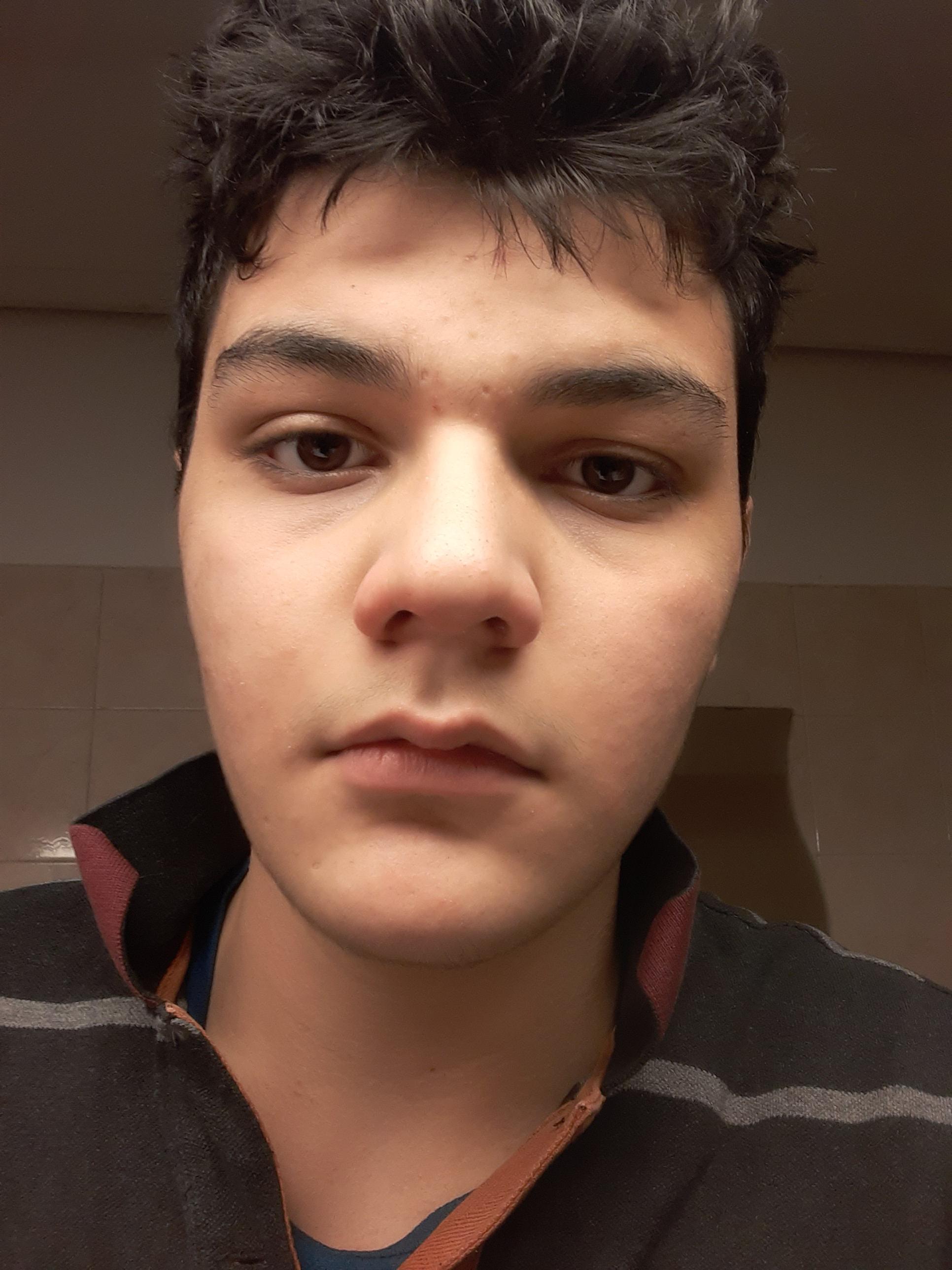 My skin is terrible🤣 | Scrolller