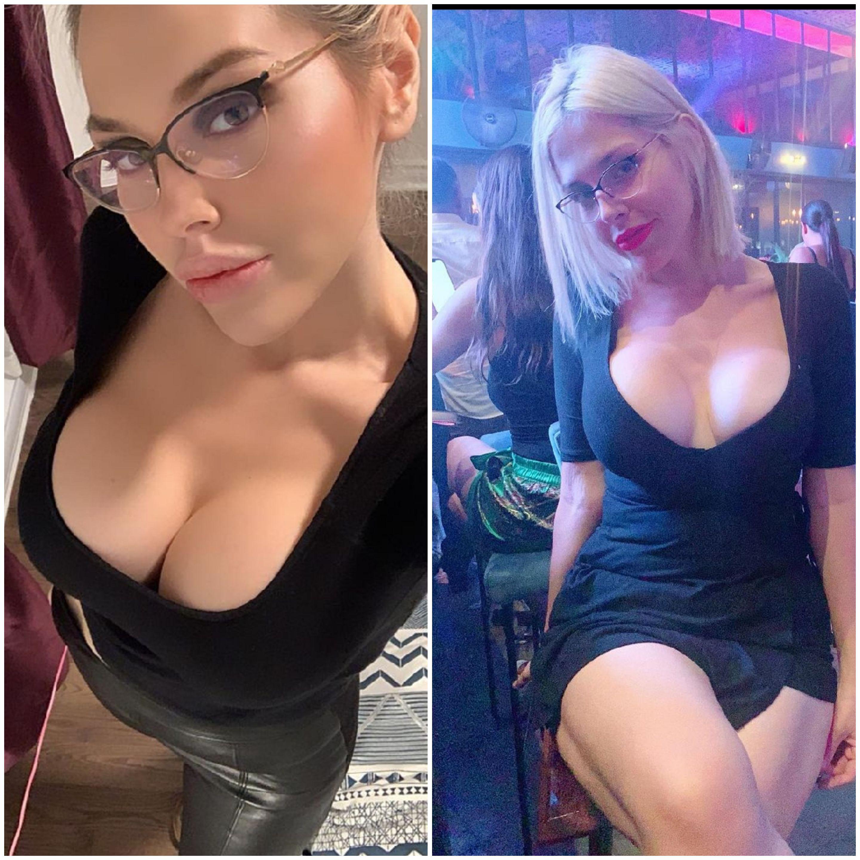 Naomi has a huge breast , but this week she is having an upgrade | Scrolller