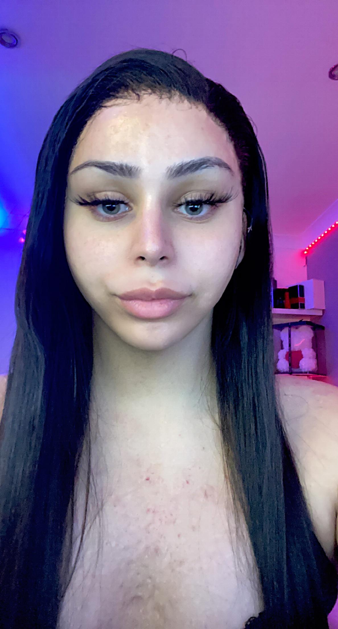 Nearly one year of estrogen my face has changed so much. Bring on the 2nd 🥰🥰🥰🥰 | Scrolller