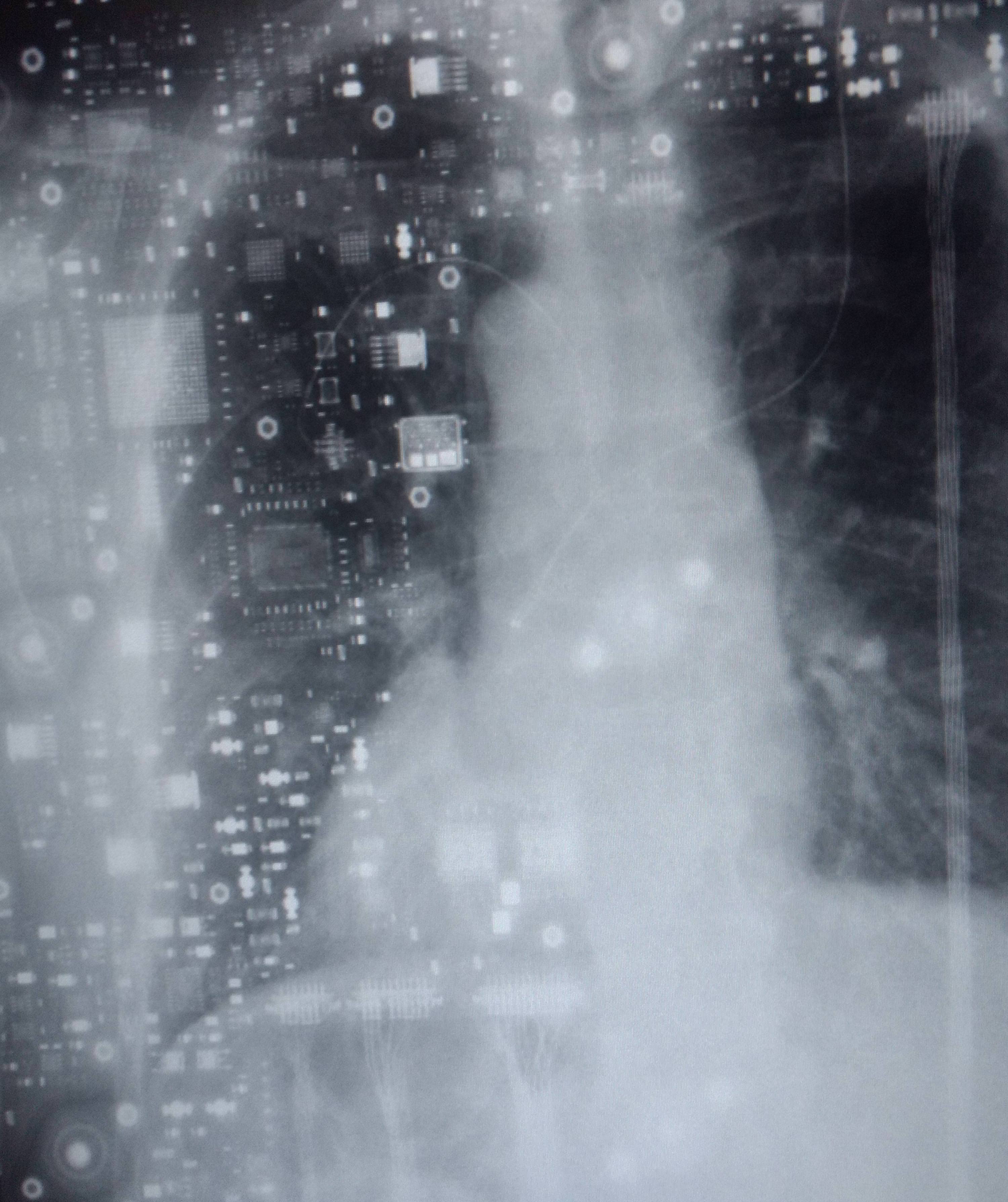 Not your ordinary chest x Ray | Scrolller