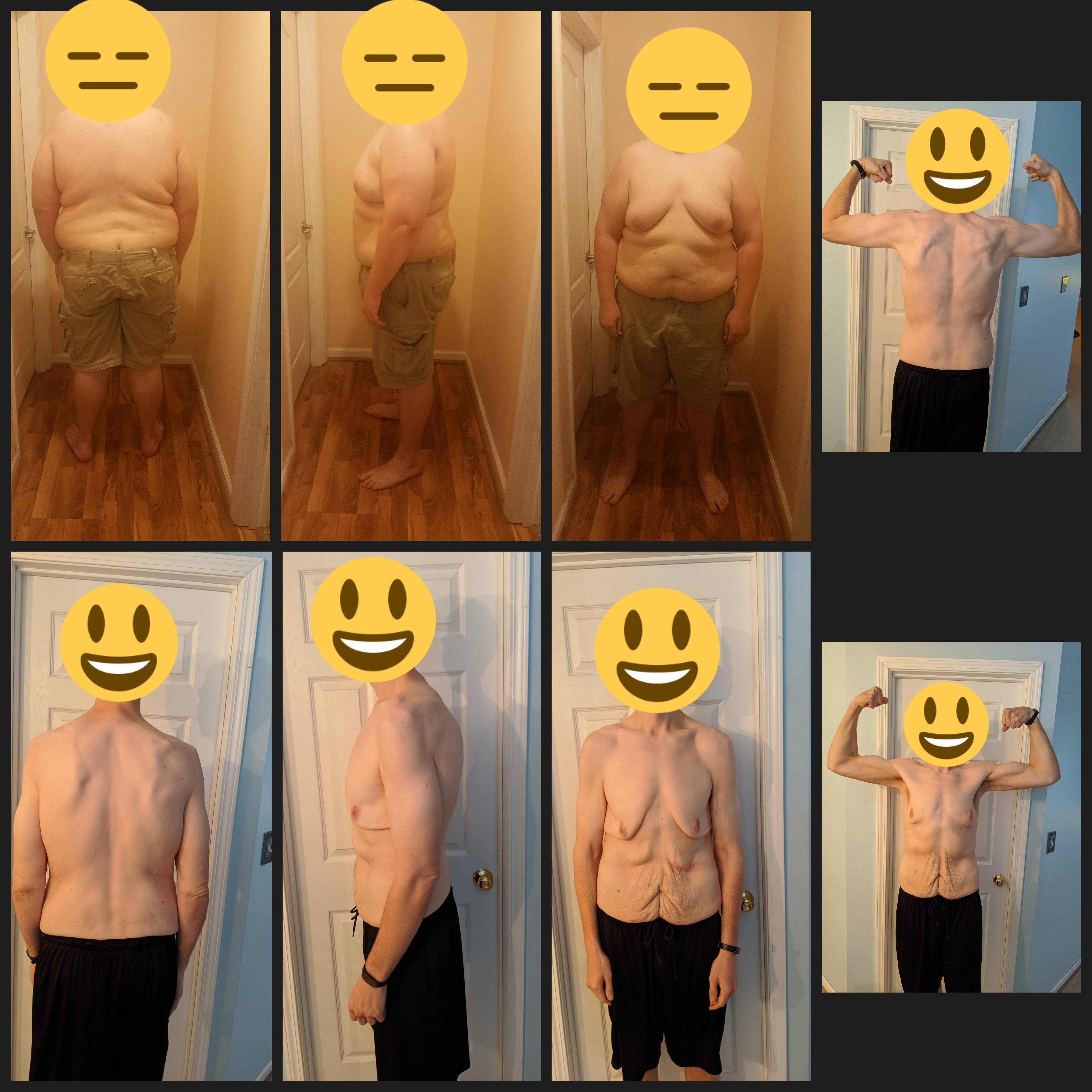 One year ago today I started my two week pre-op fast! Down from ~370lbs to 185lbs on a ...