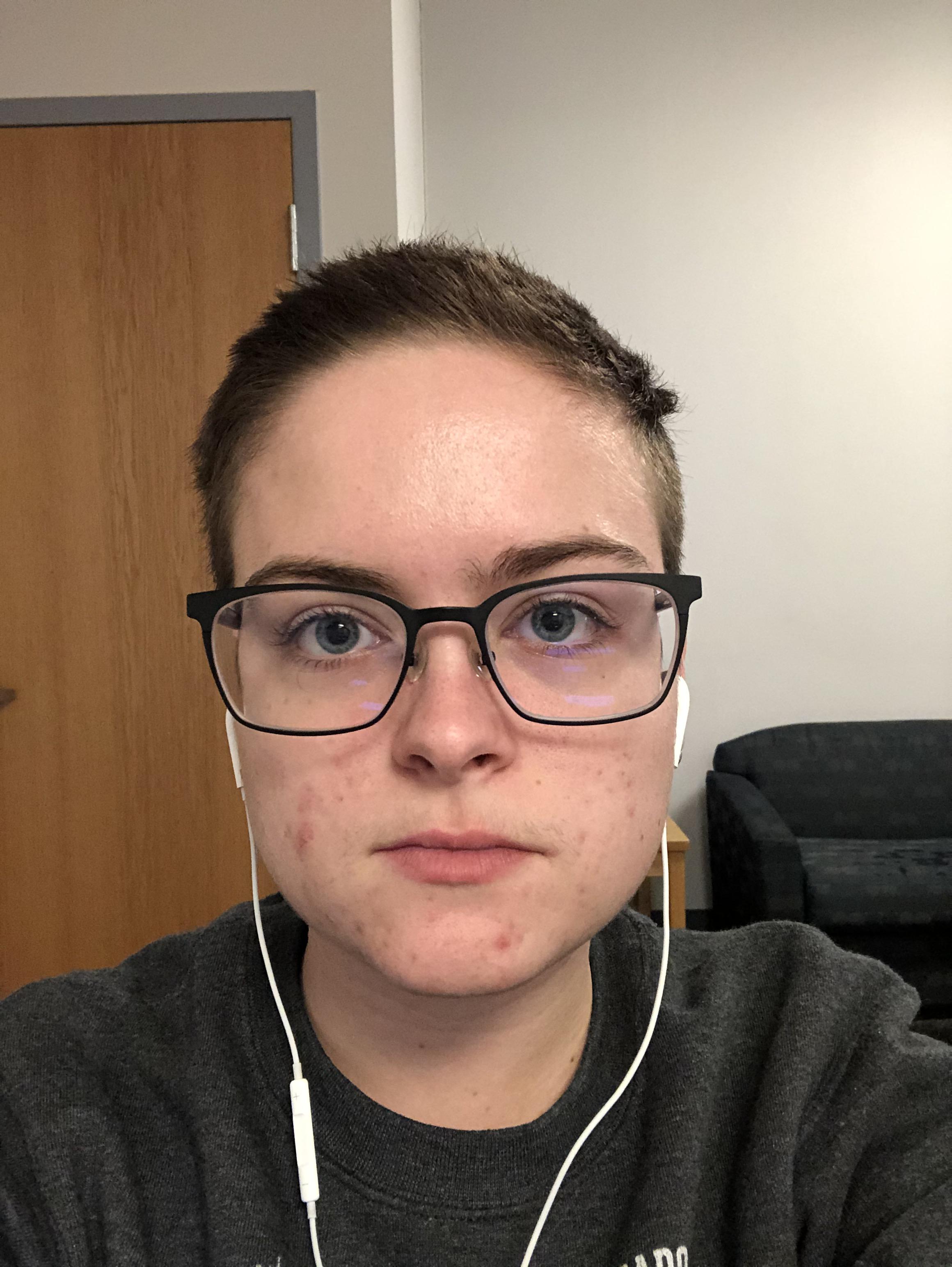 Passing? Age? T? | Scrolller