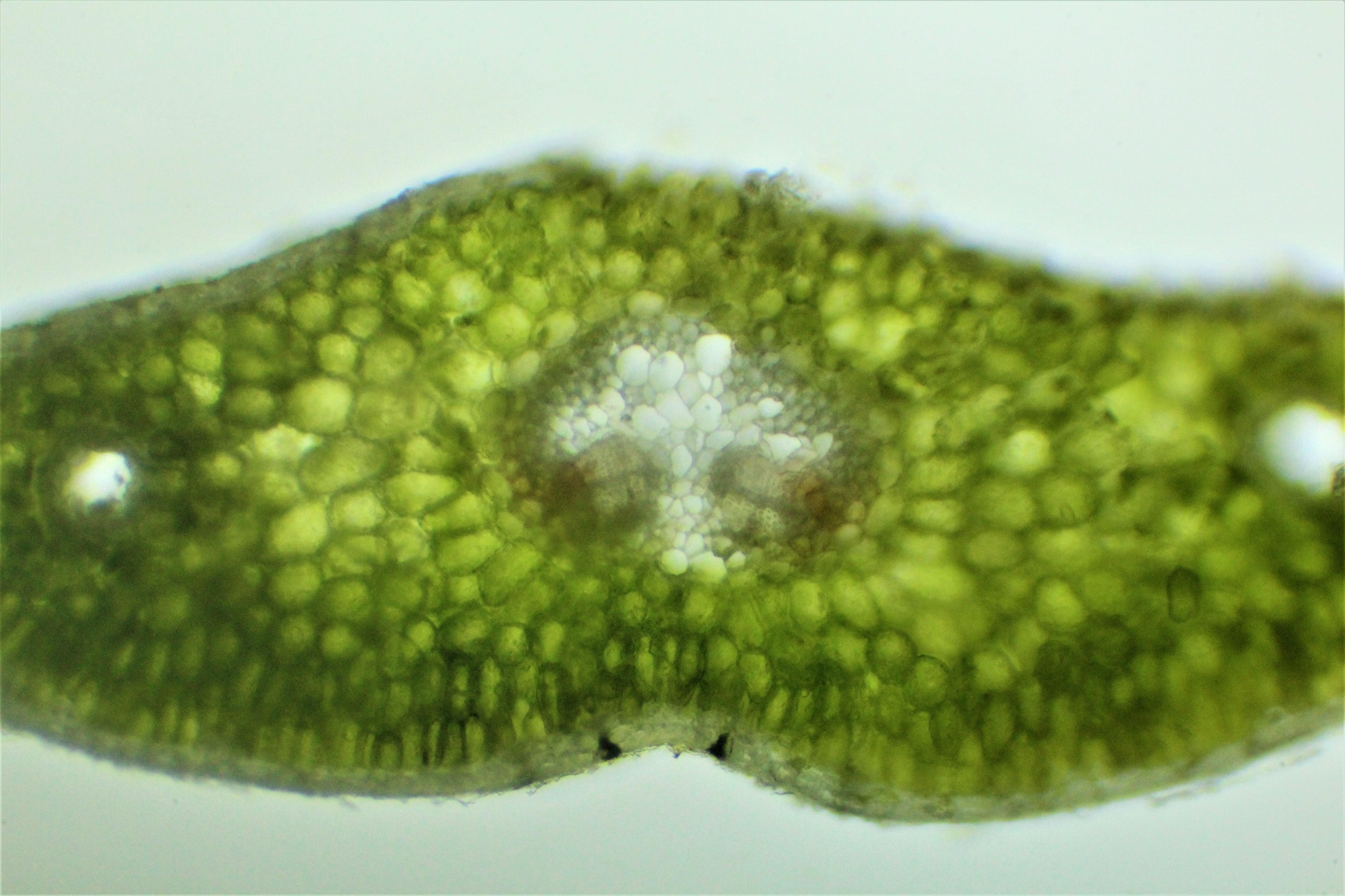 Pine Needle Cross Section From My Christmas Tree 250X-400X | Scrolller