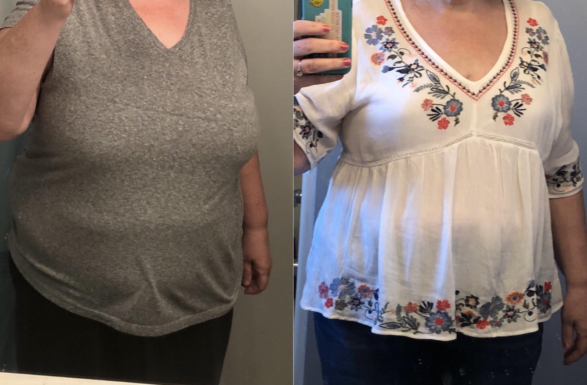 Plus Size Before/After | Scrolller