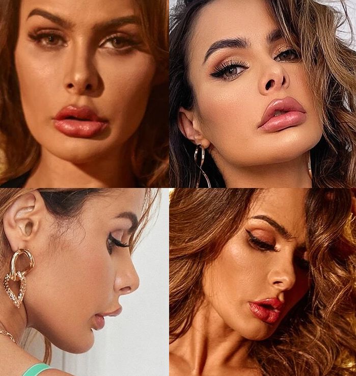 Poor Shein model with wonky overfilled lips | Scrolller