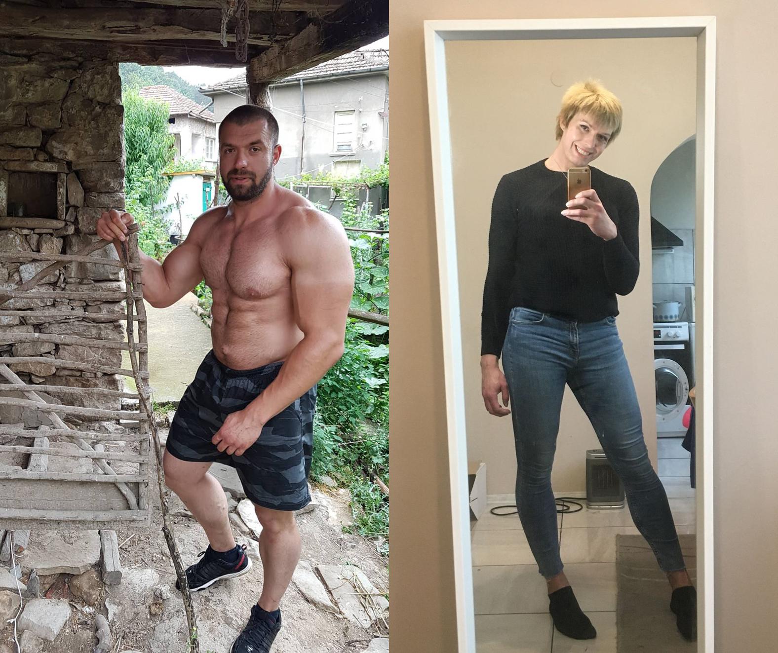Pre HRT vs 10 months HRT : ) , 35 Y.O. / 17.06.2020 vs 18/04/2021 / Progress..... | Scrolller