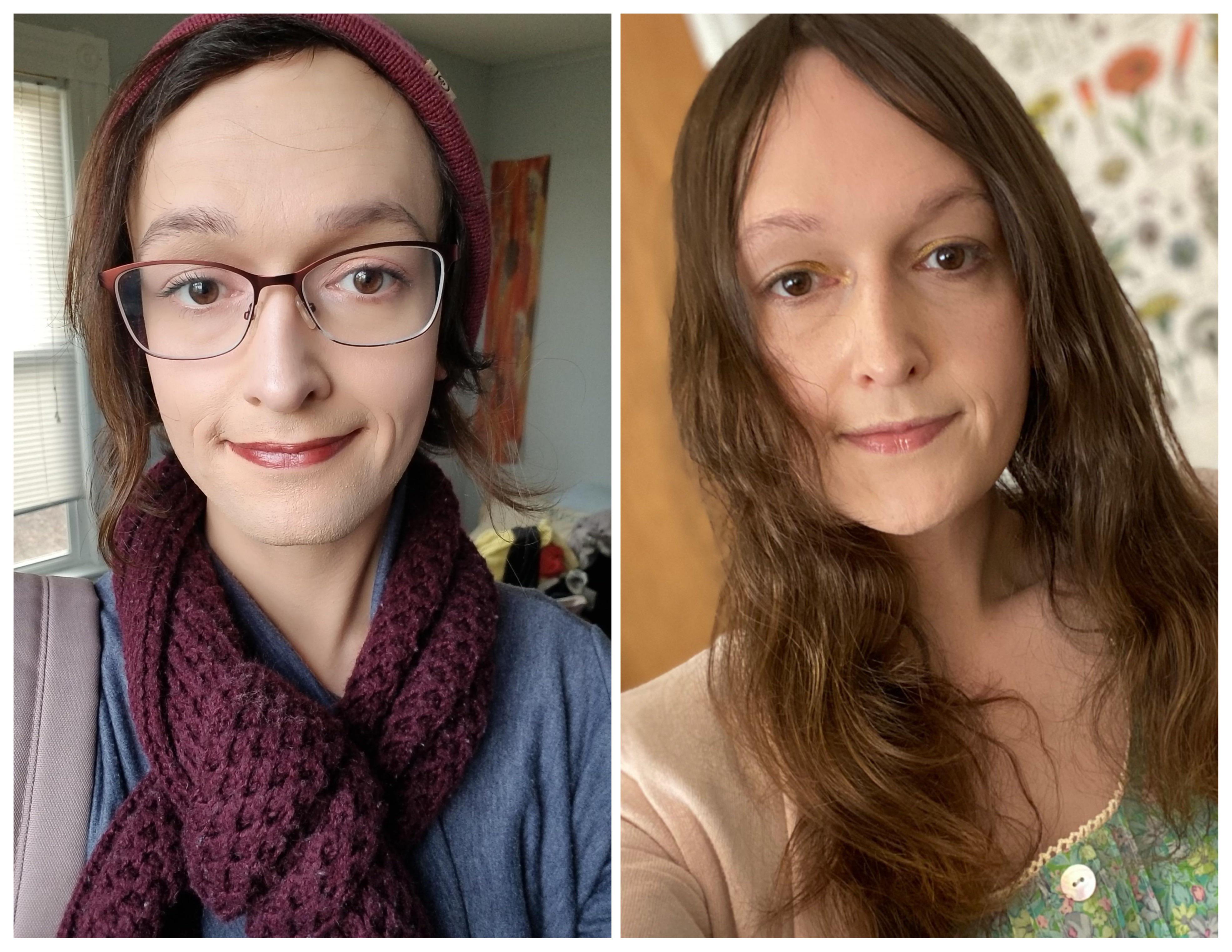 Pre to 2 years hrt and 8 laser sessions 💗 | Scrolller
