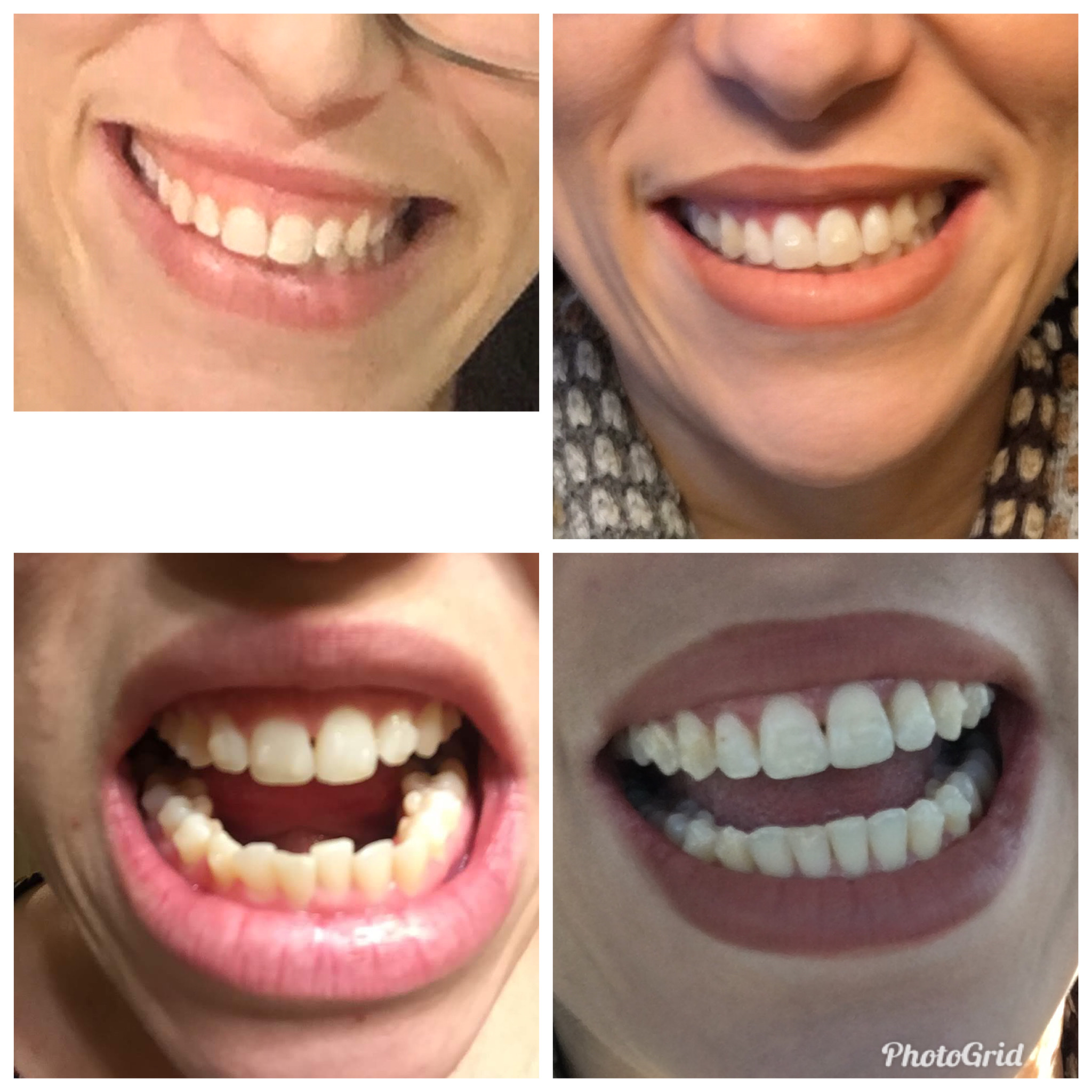 Progress Pics - nearly finished! | Scrolller