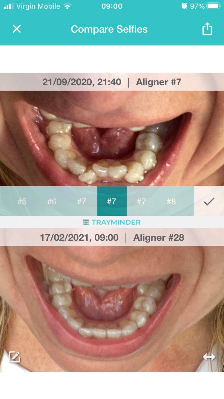 Progress picture in 8 months | Scrolller