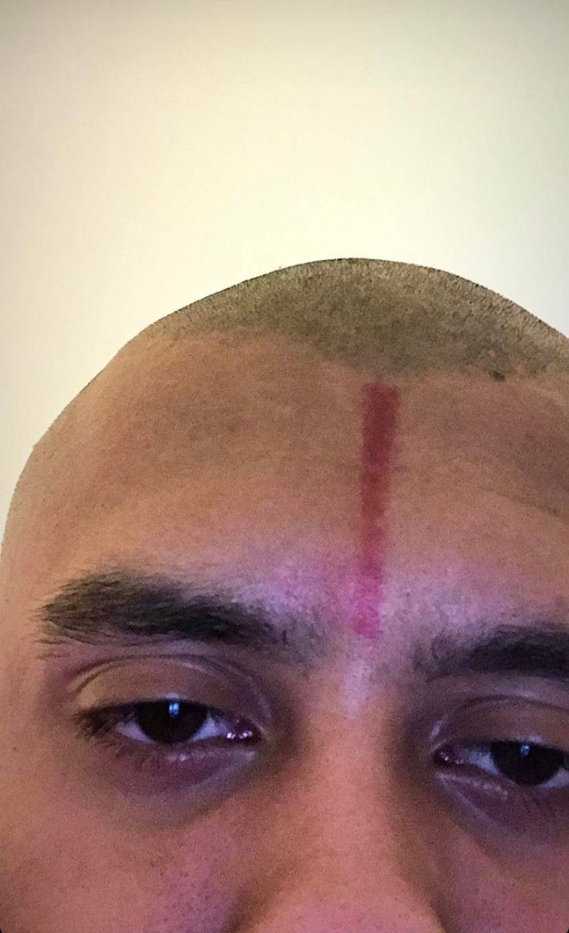 RED LINE FOREHEAD FAGGOT | Scrolller