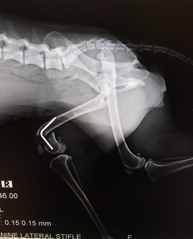 Refractured femur | Scrolller
