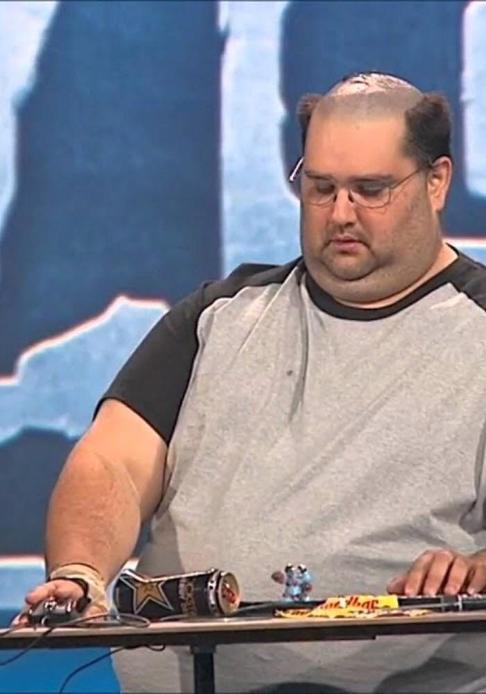 Richard when that male pattern baldness sets in | Scrolller