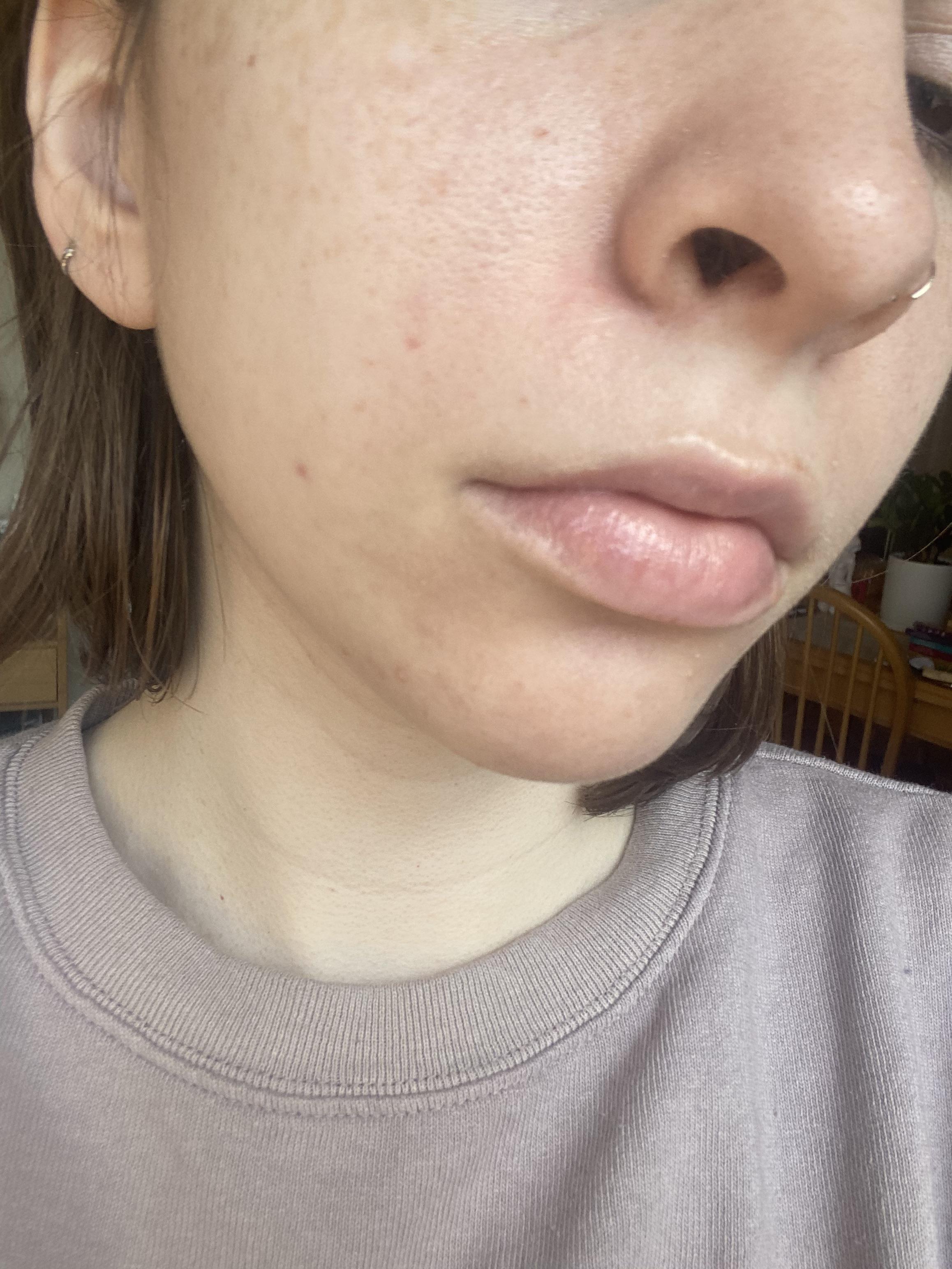 [Routine Help] description in comments! | Scrolller