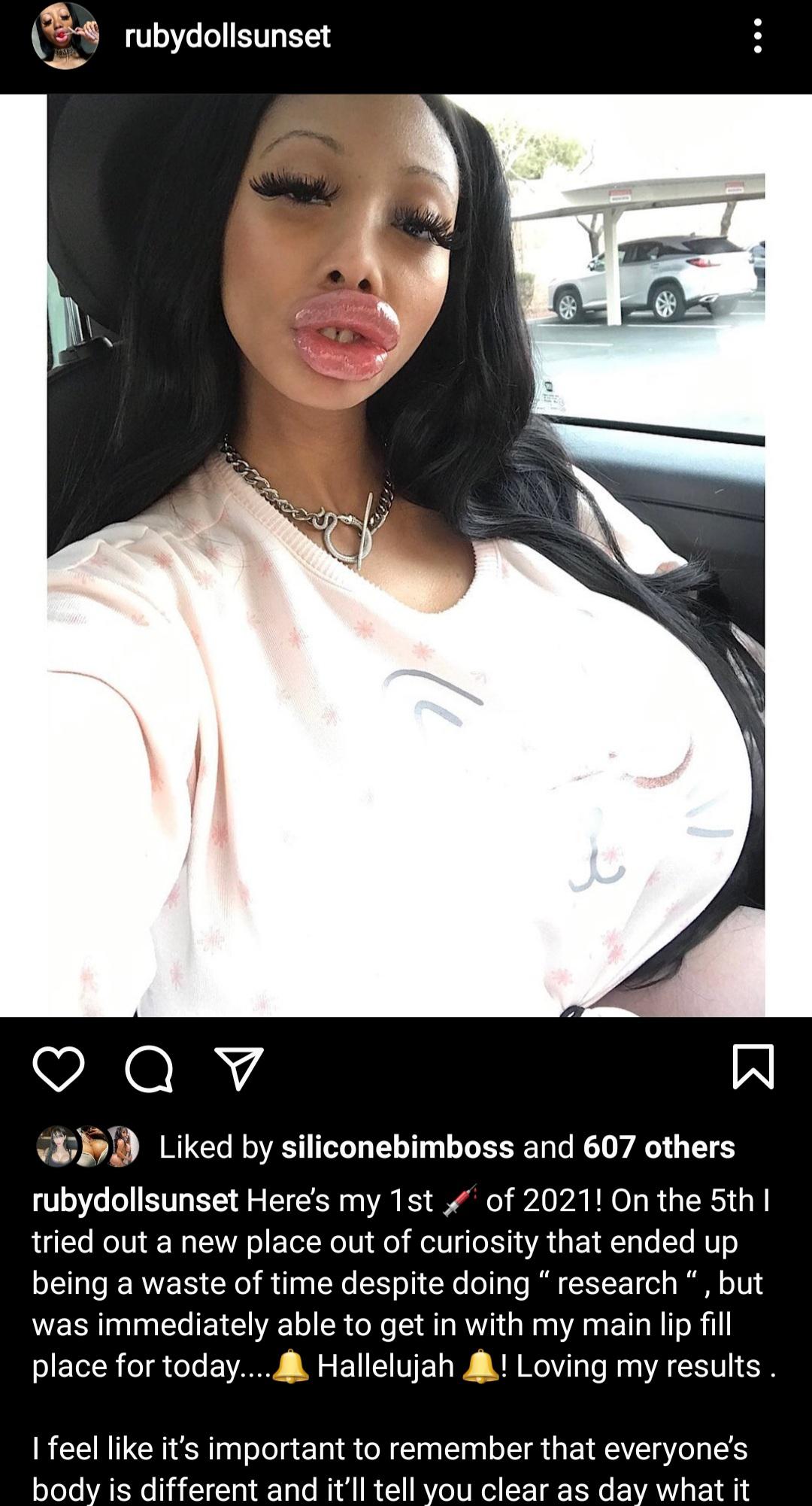 @Rubydollsunset What do you think about her lips? Do you guys like it? | Scrolller