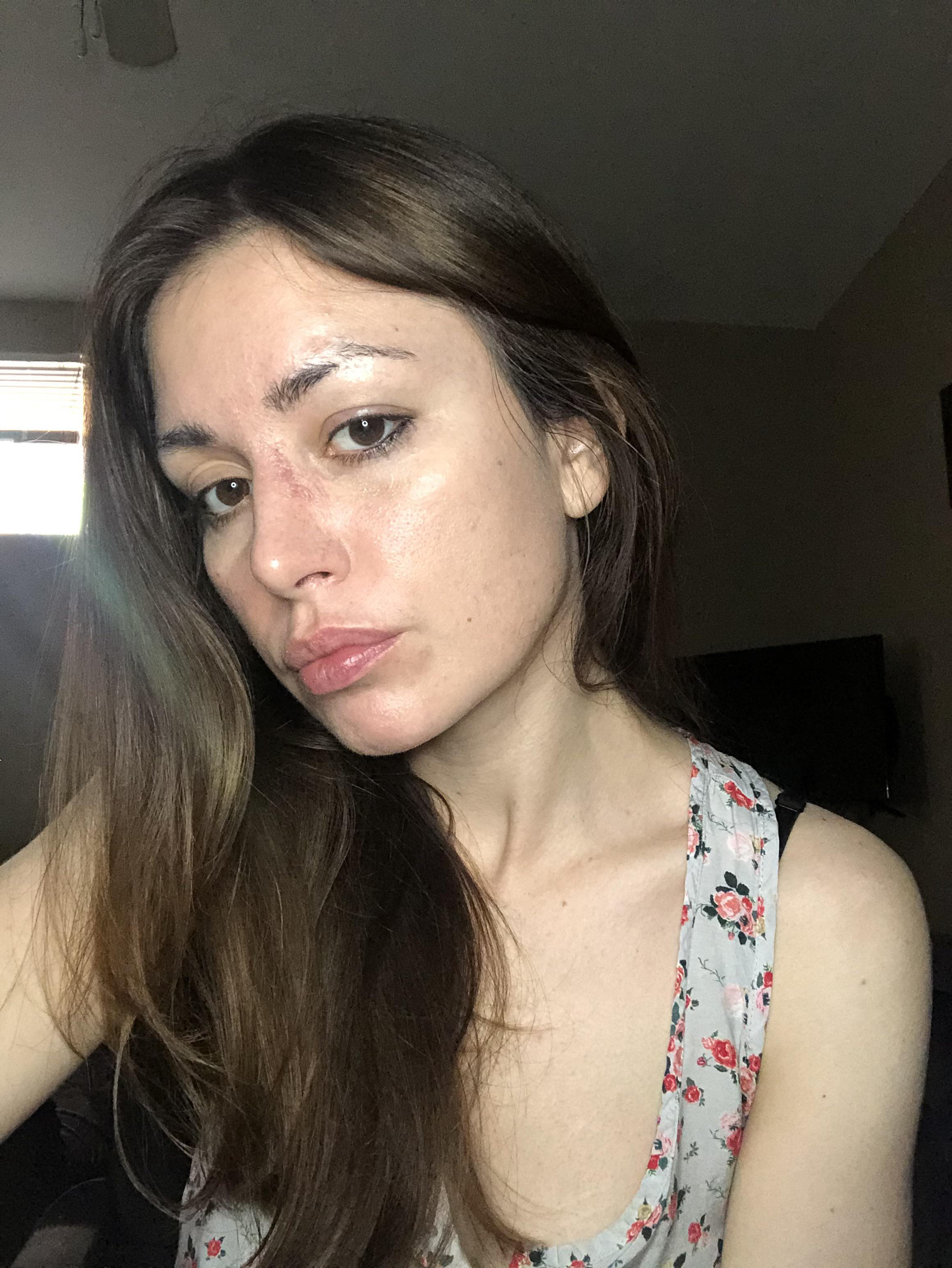 Scars are showing 🤫 | Scrolller