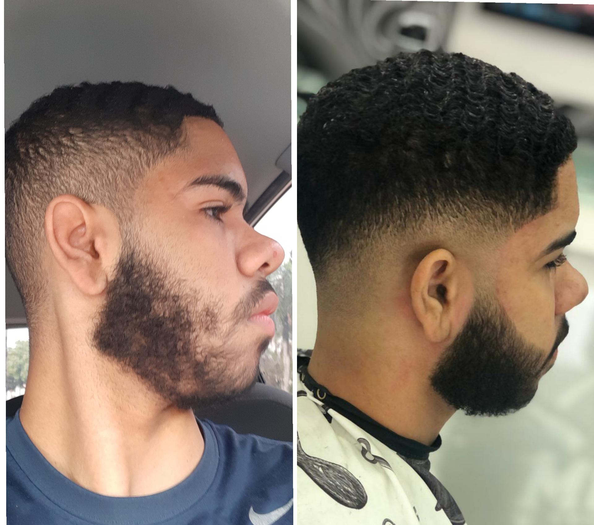 Shedding phase is over. | Scrolller