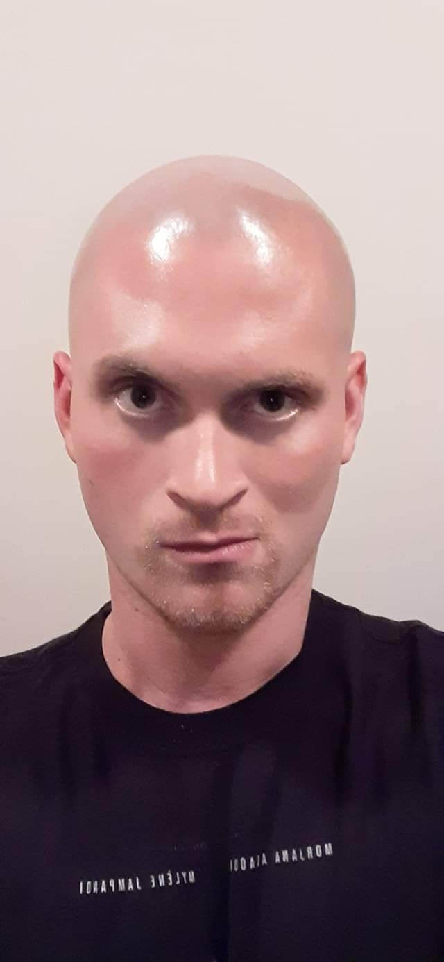 Shiny Bald Head Bald By Choice Scrolller