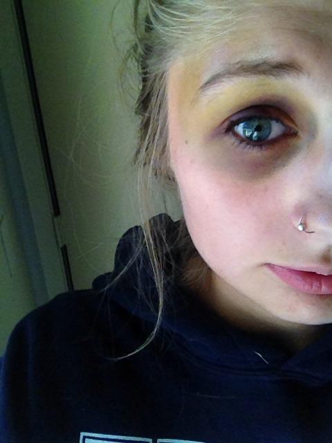 Soft and bruised | Scrolller