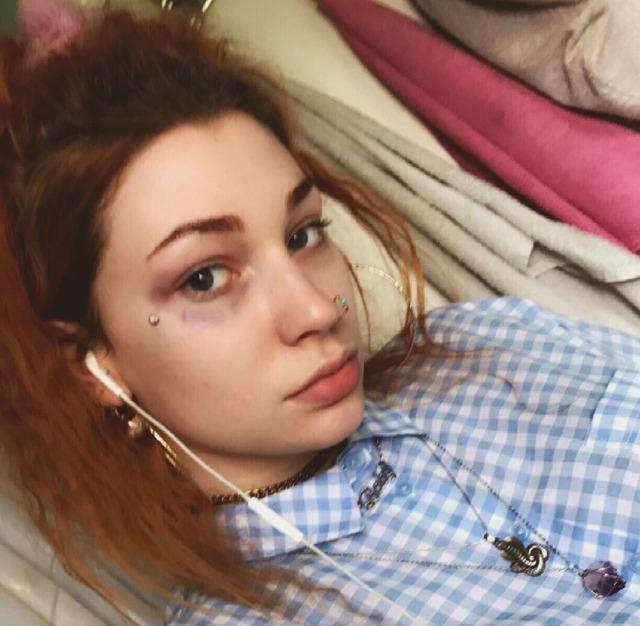 Something about that fully buttoned up shirt... And the black eye... | Scrolller