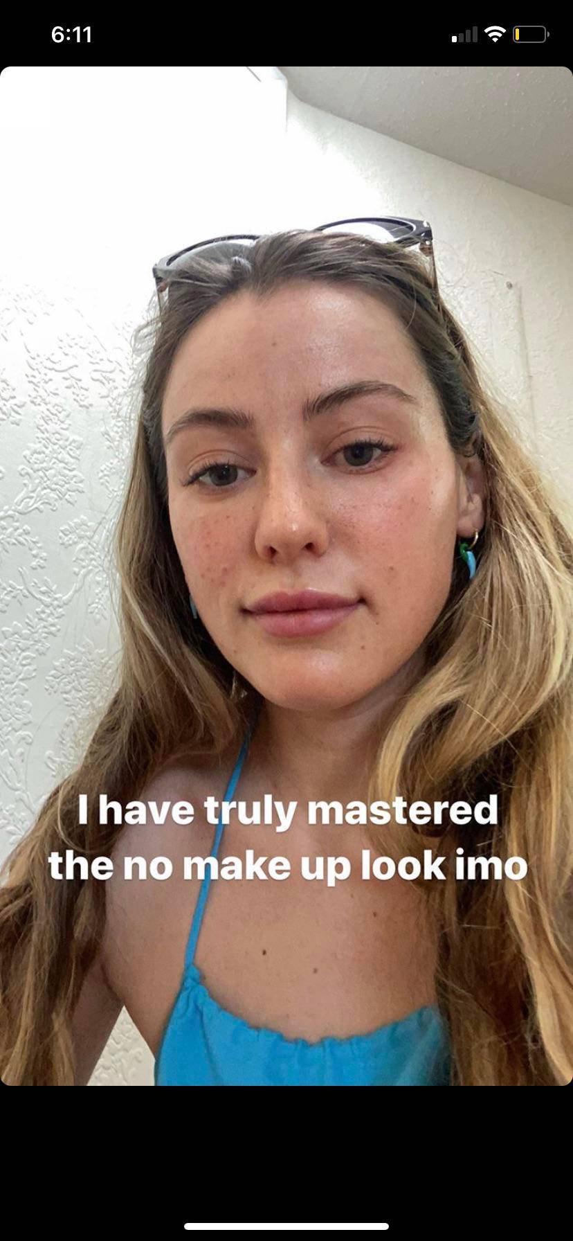 Step 1: nose job / Step 2: lash lift / Step 3: lip fillers. | Scrolller