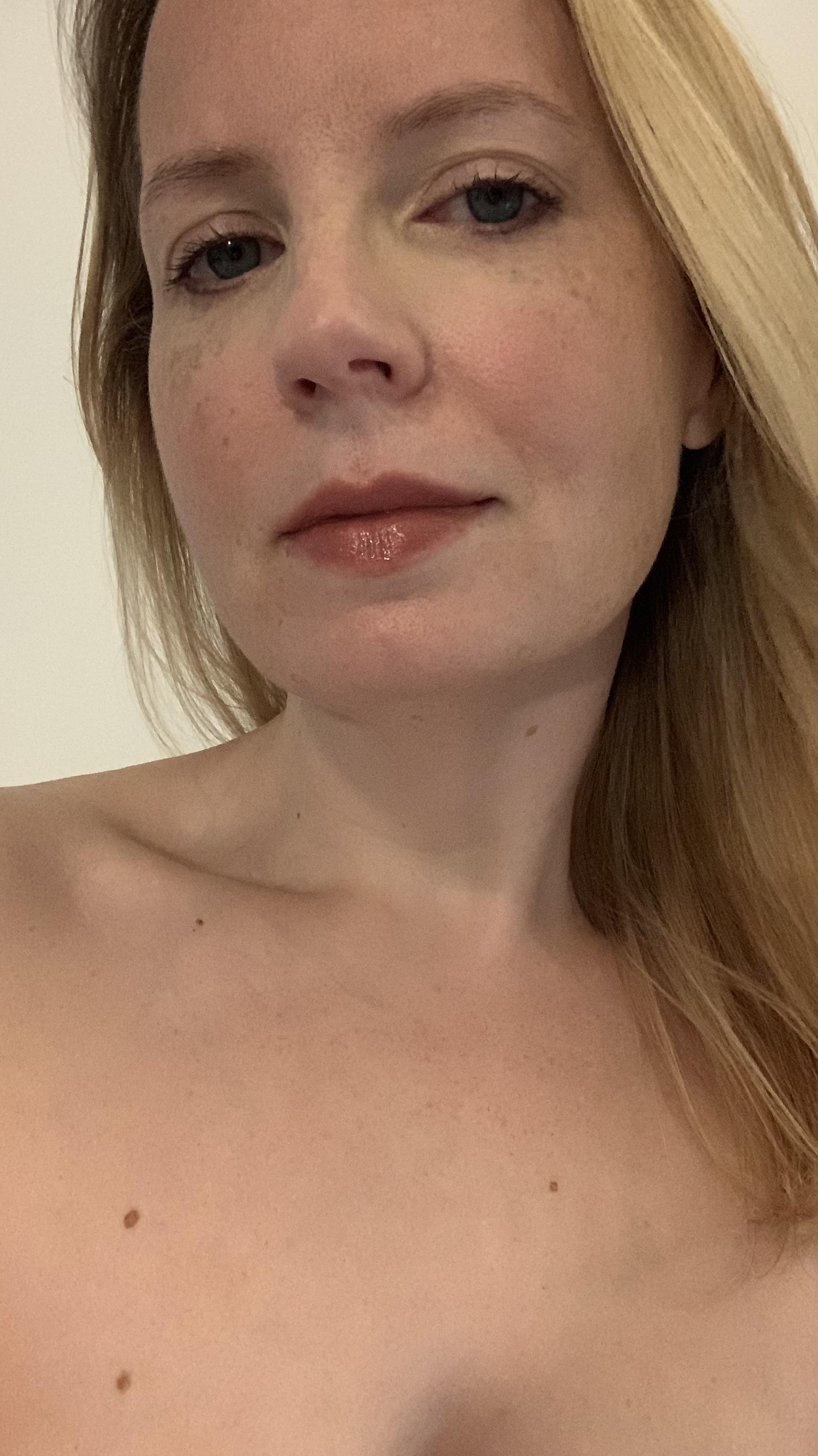 Still Popping Freckles At 47 | Scrolller