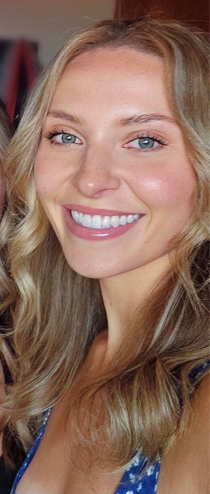 Summer glow 🌞 | Scrolller