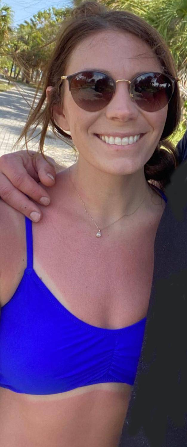 sunburnt | Scrolller