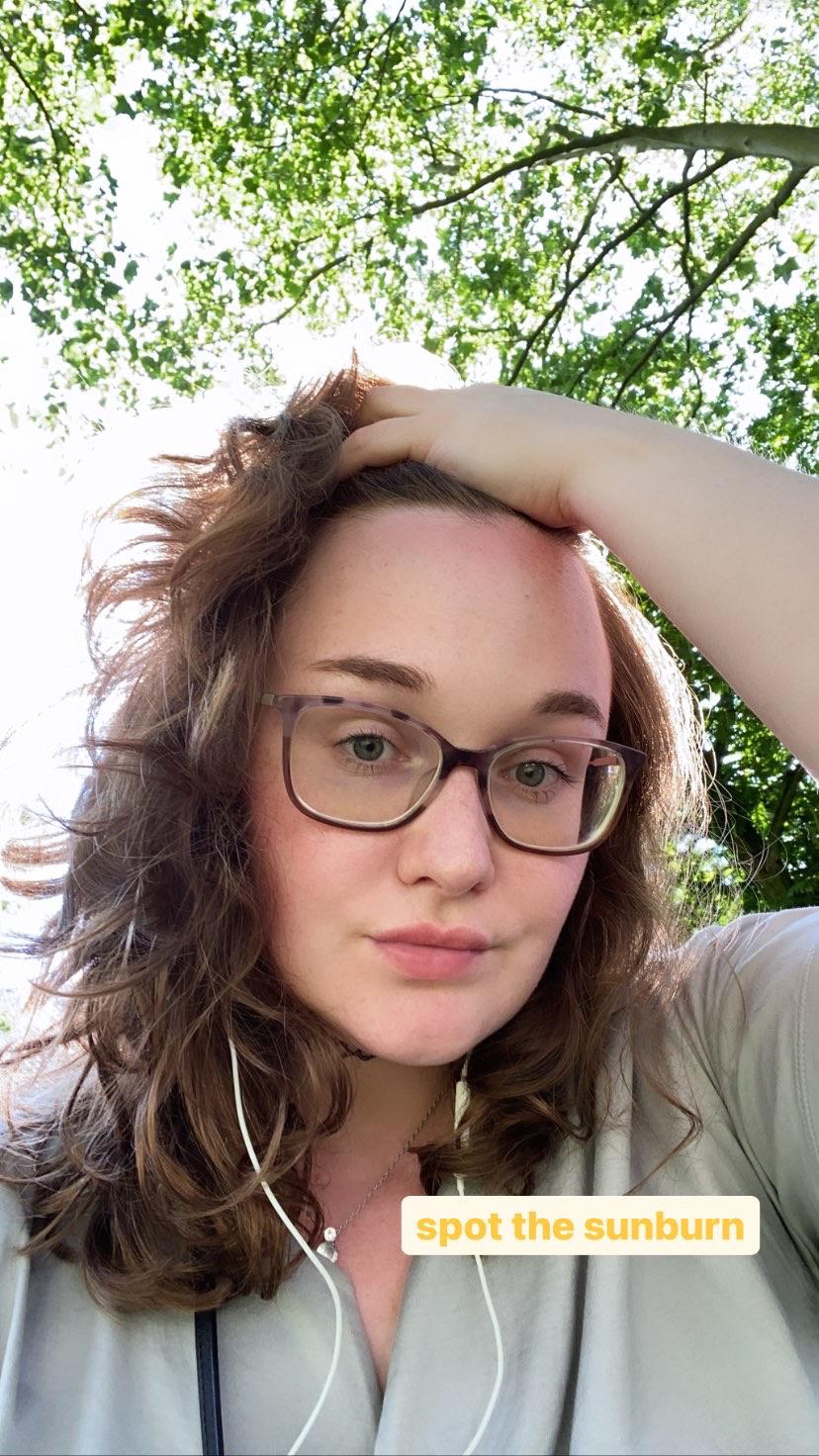 sunburnt 🌞 | Scrolller