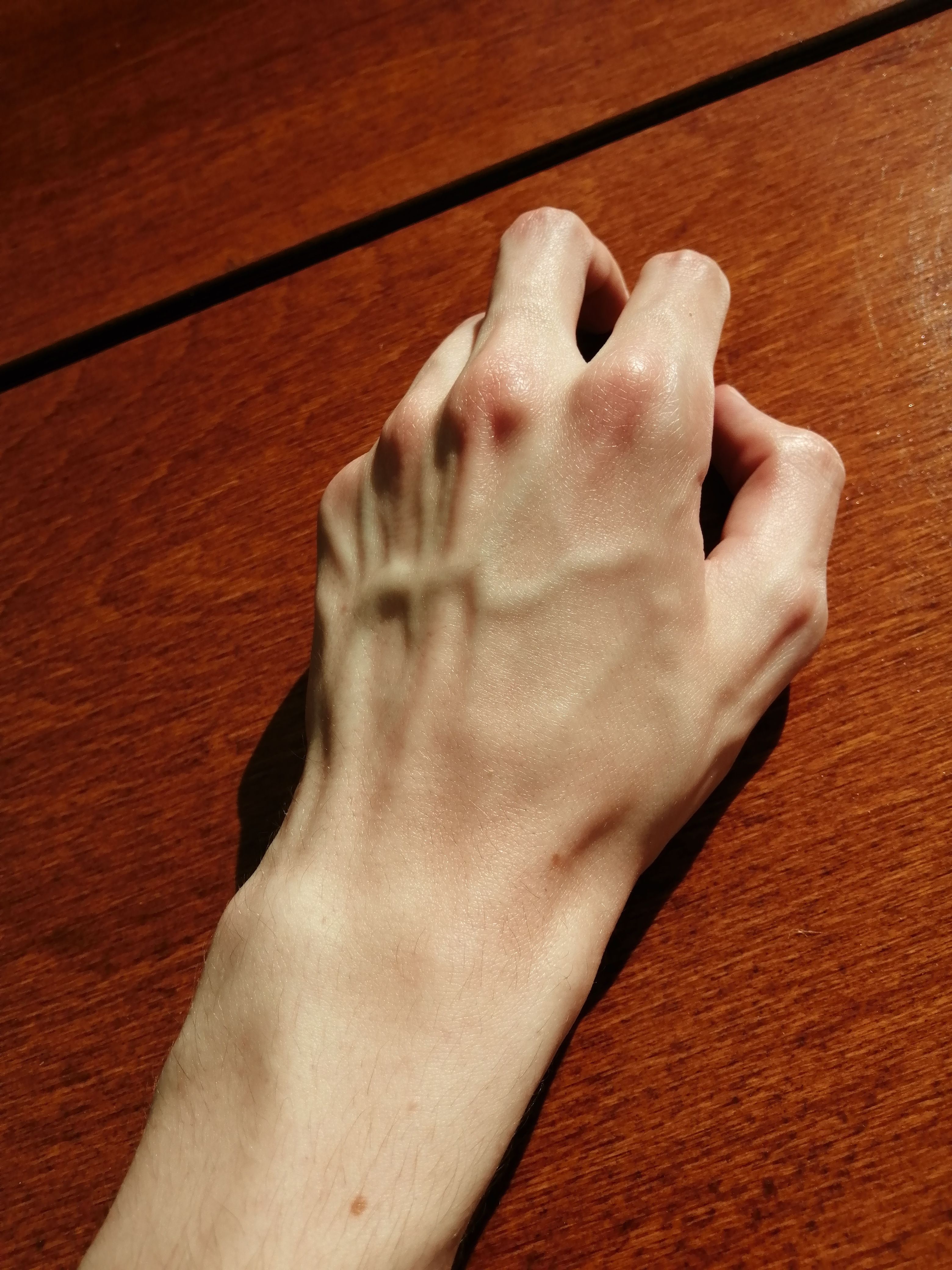 sunny veins | Scrolller