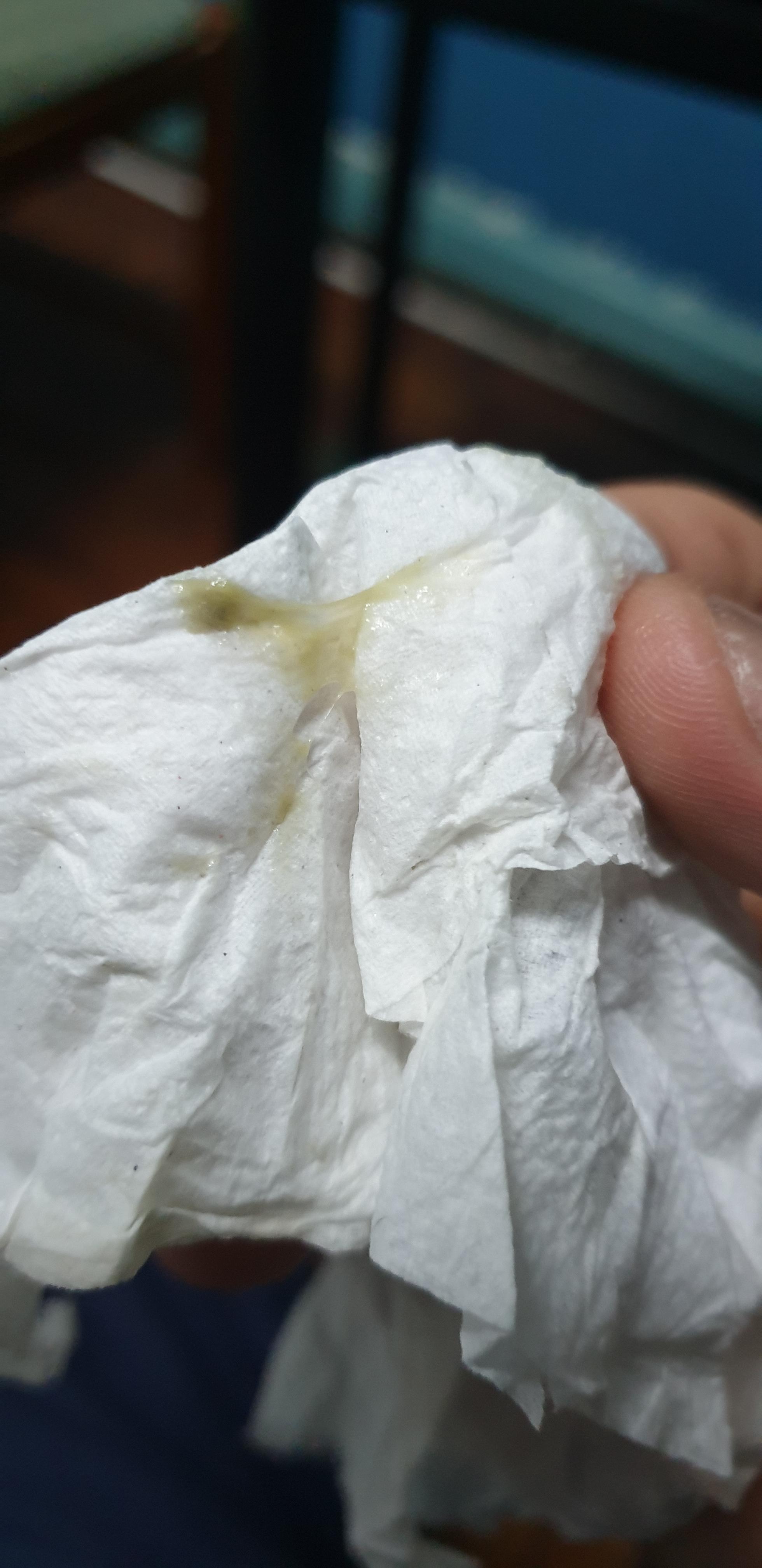 Sweet relief! | Scrolller