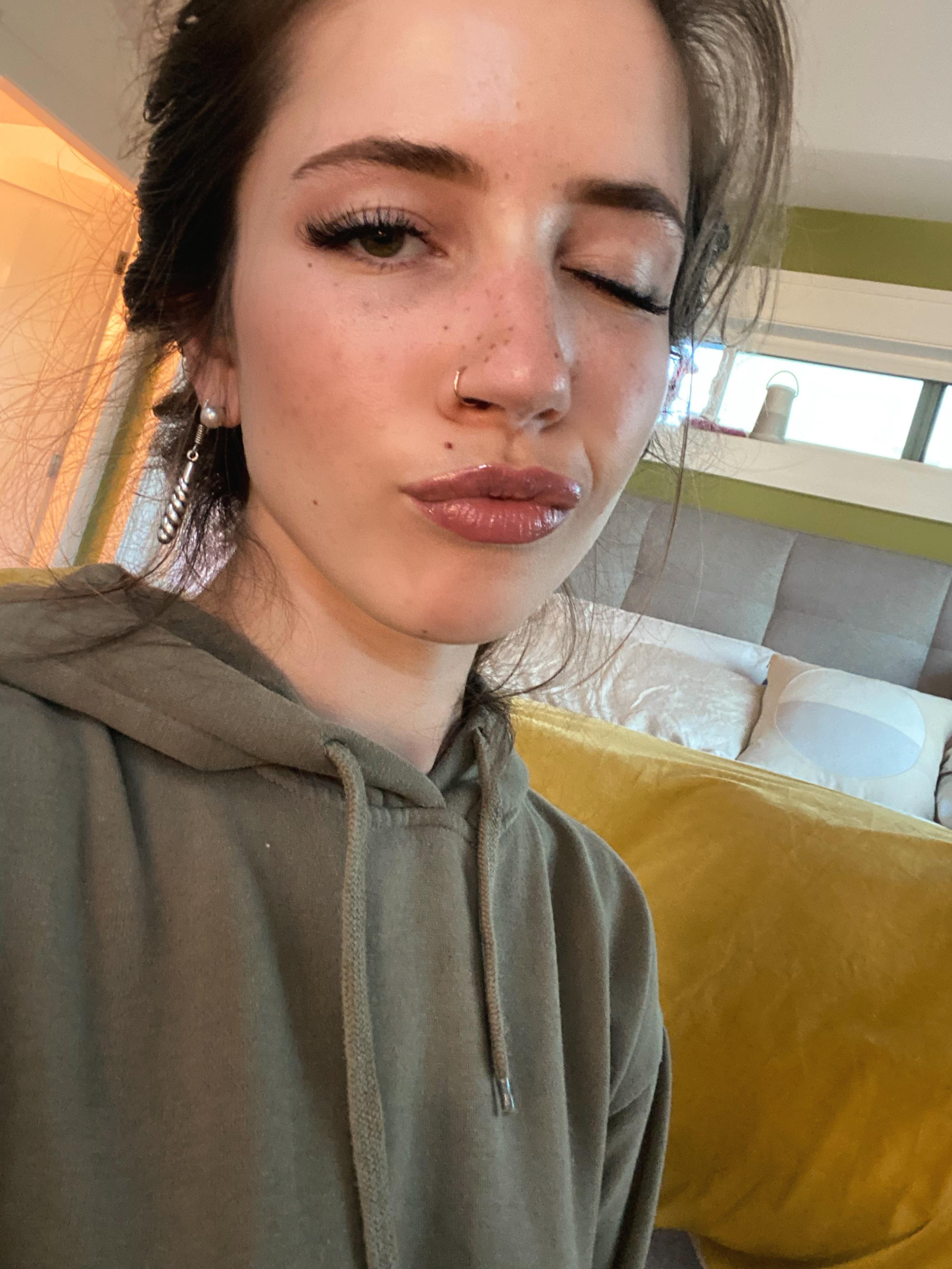 Technically *dat eye, but I think it still qualifies, right? | Scrolller