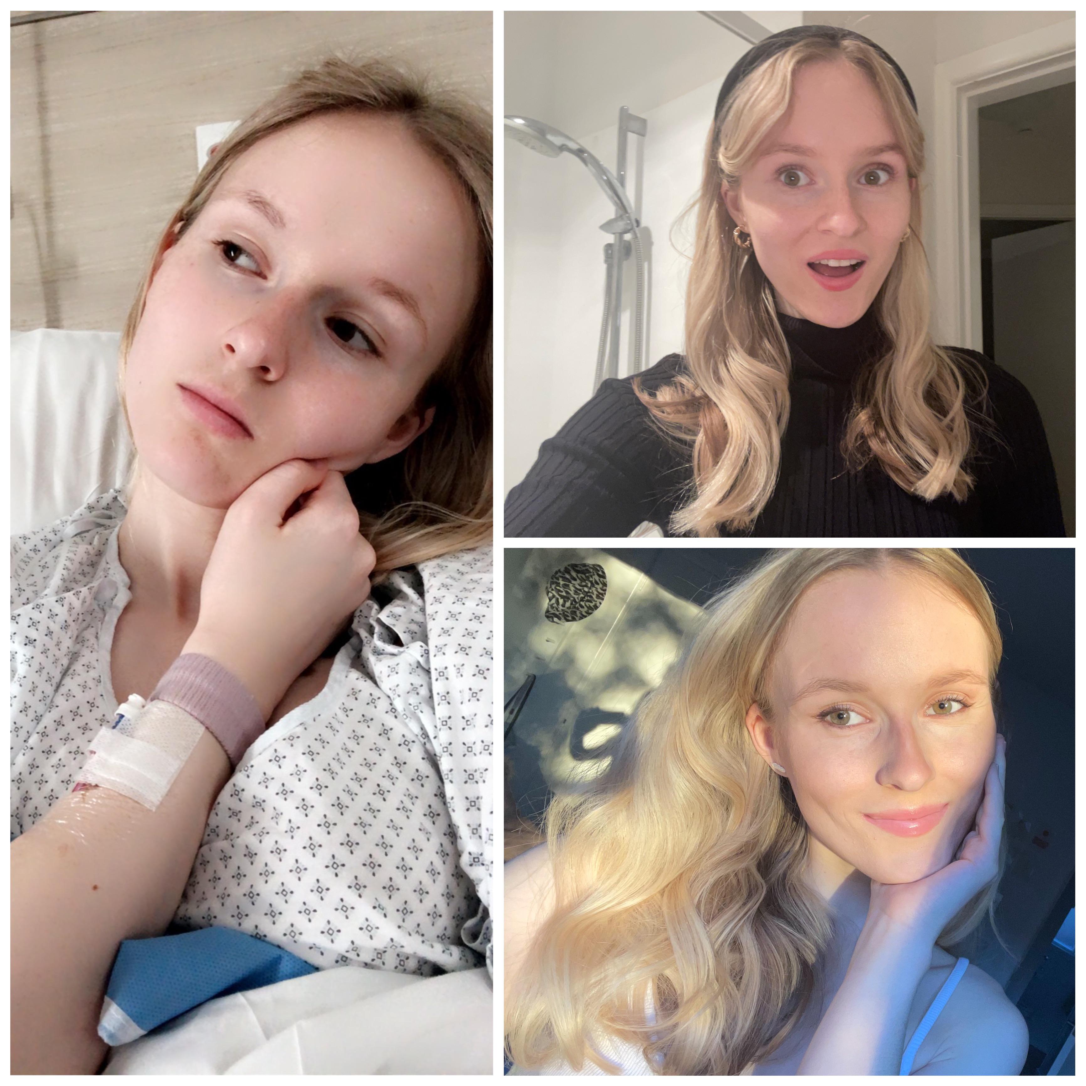 The difference a year makes. Almost a year post laparoscopy. Gained weight and confidence ...