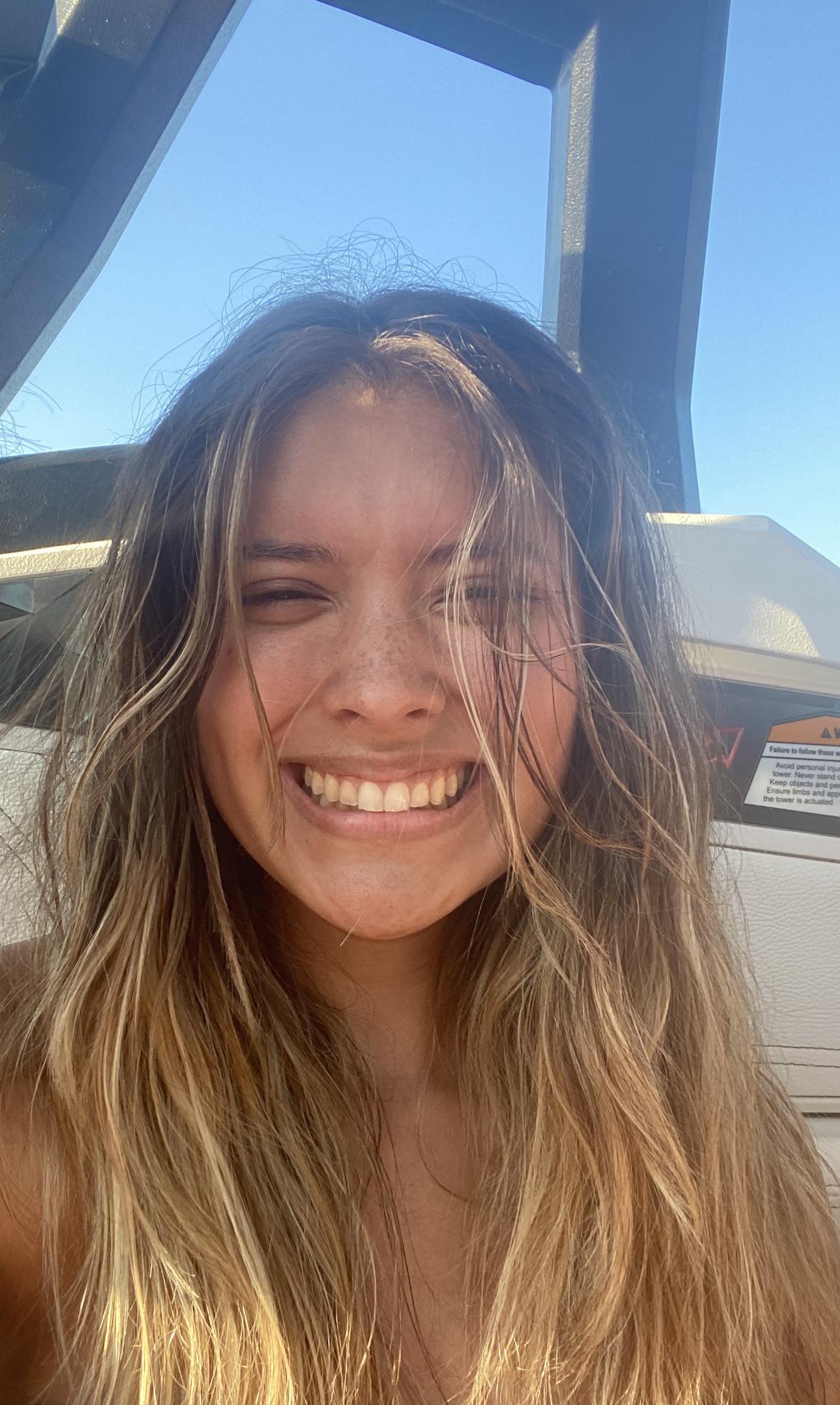 The freckles came out :’) | Scrolller