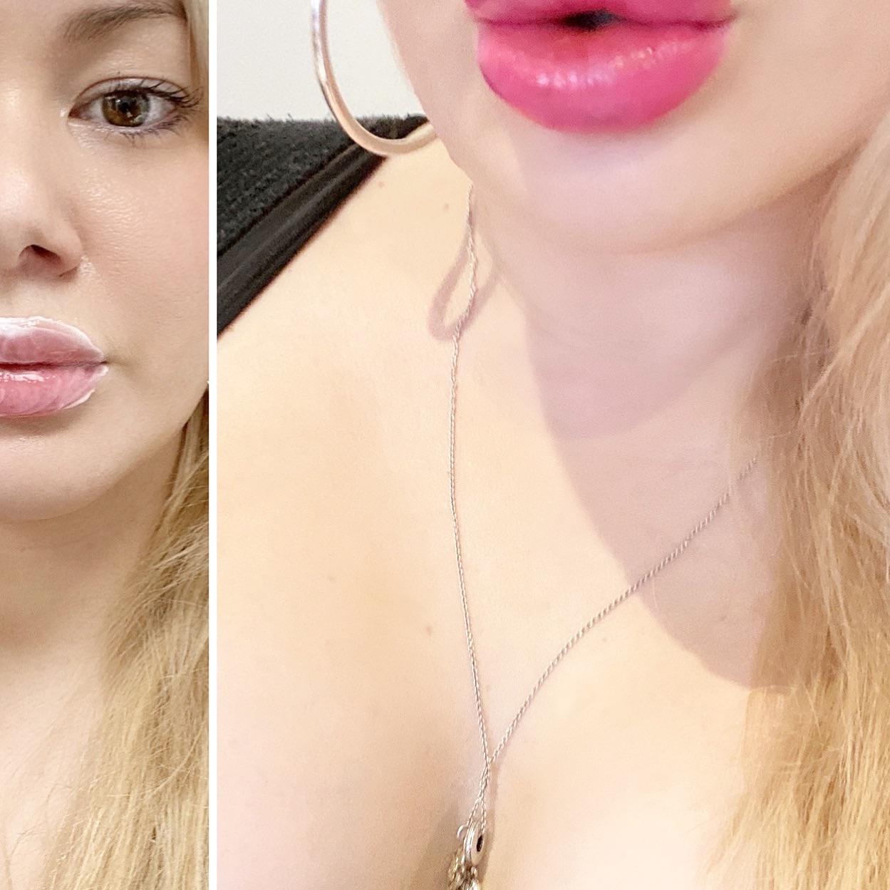 The permanent gap and occasional drool has my head spinning with desire 🤤😍 | Scrolller