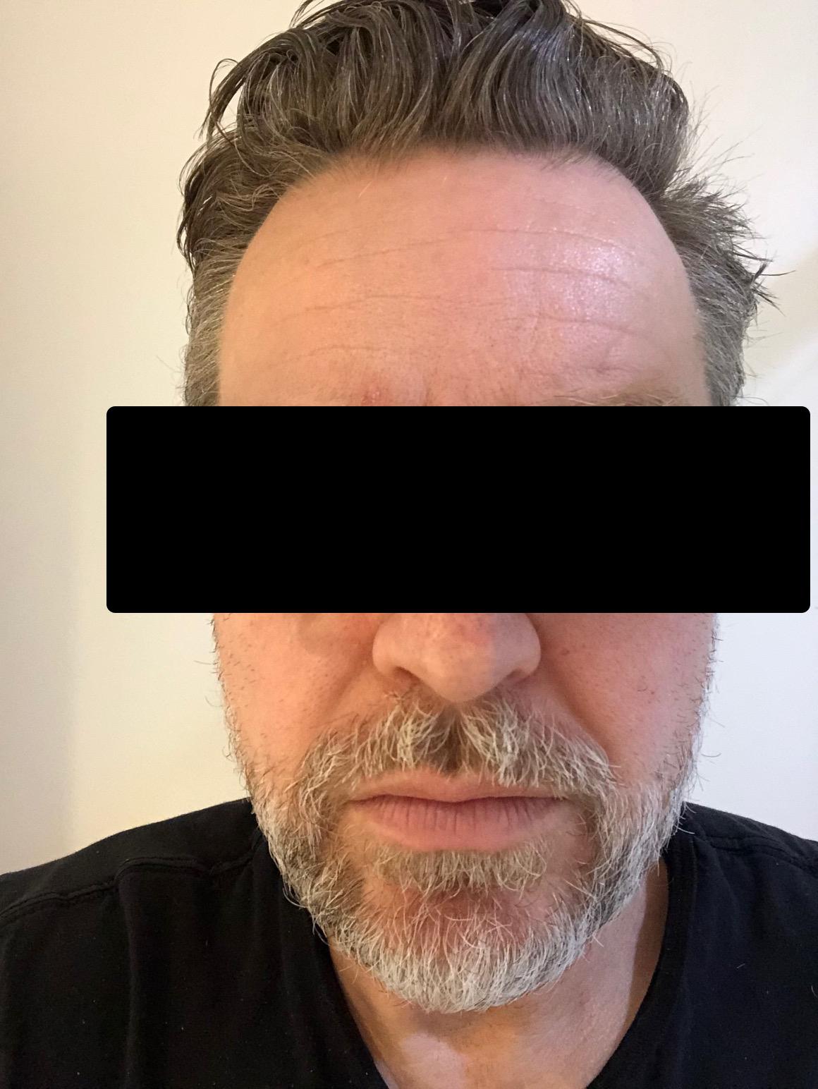 THE "PSTH PAYOFF BEARD" CHALLENGE... WEEK 3 | Scrolller