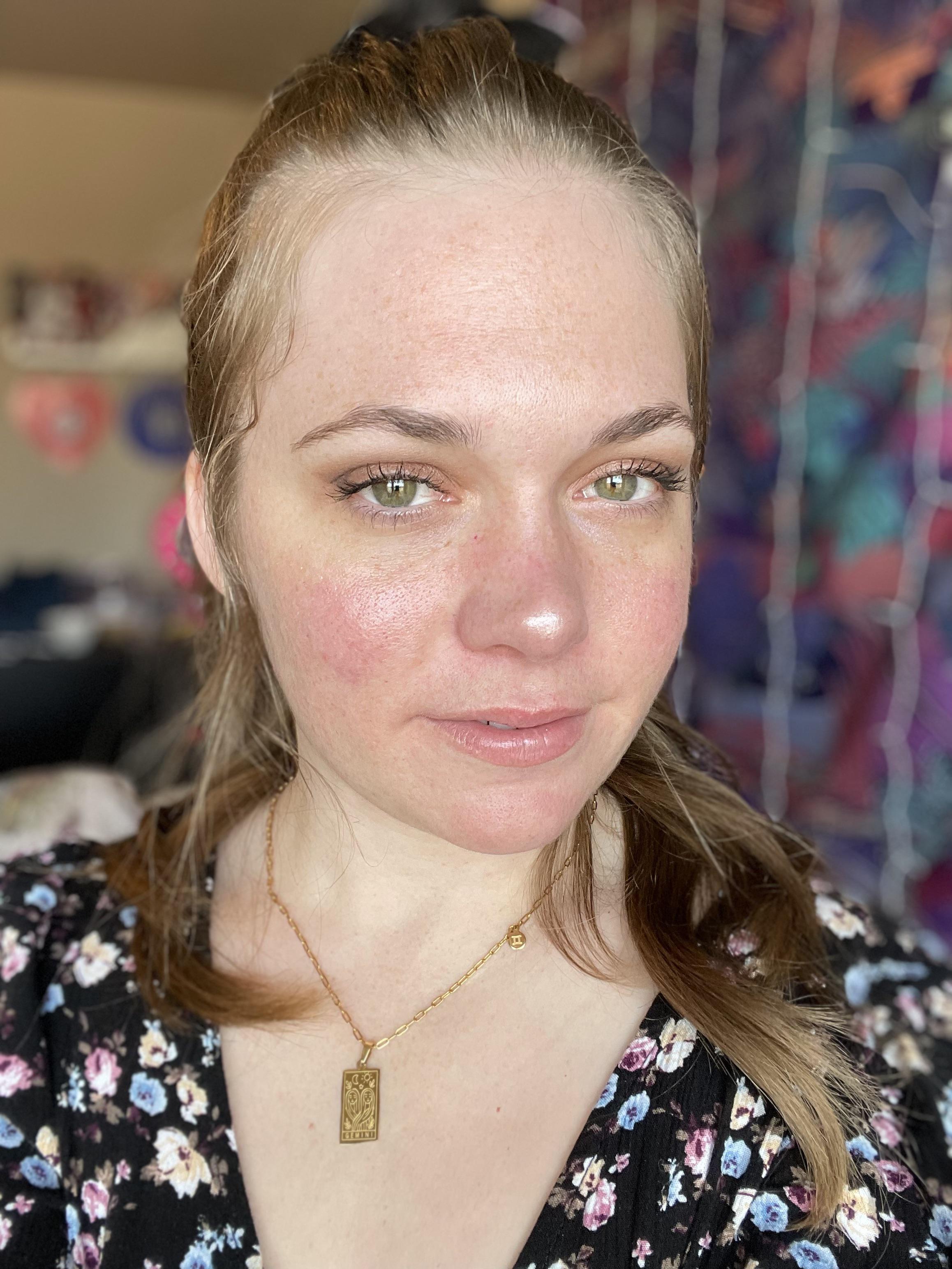 The sun loves to give my temple lots of kisses 😗 | Scrolller