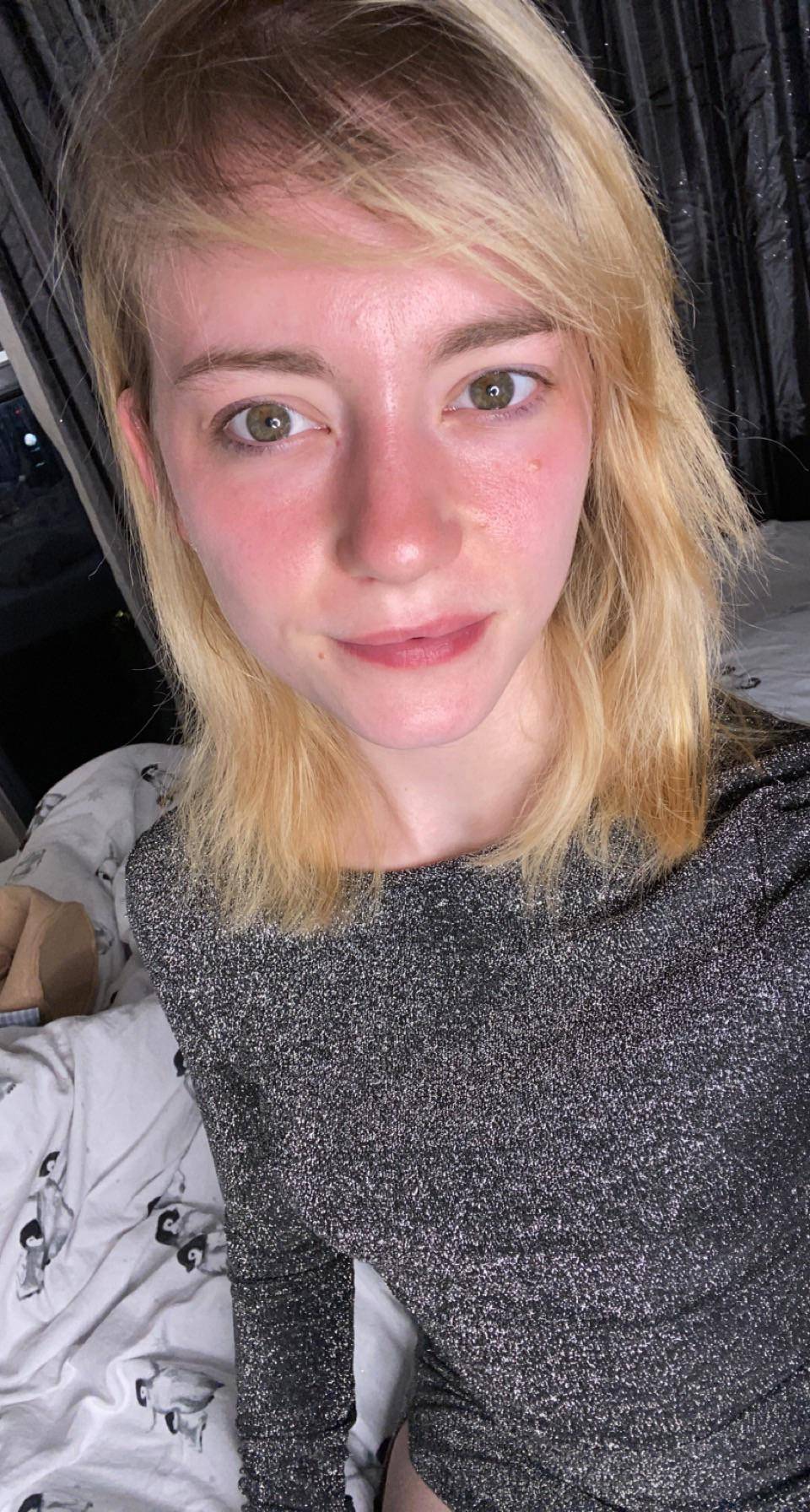 Think I got a tad burnt | Scrolller