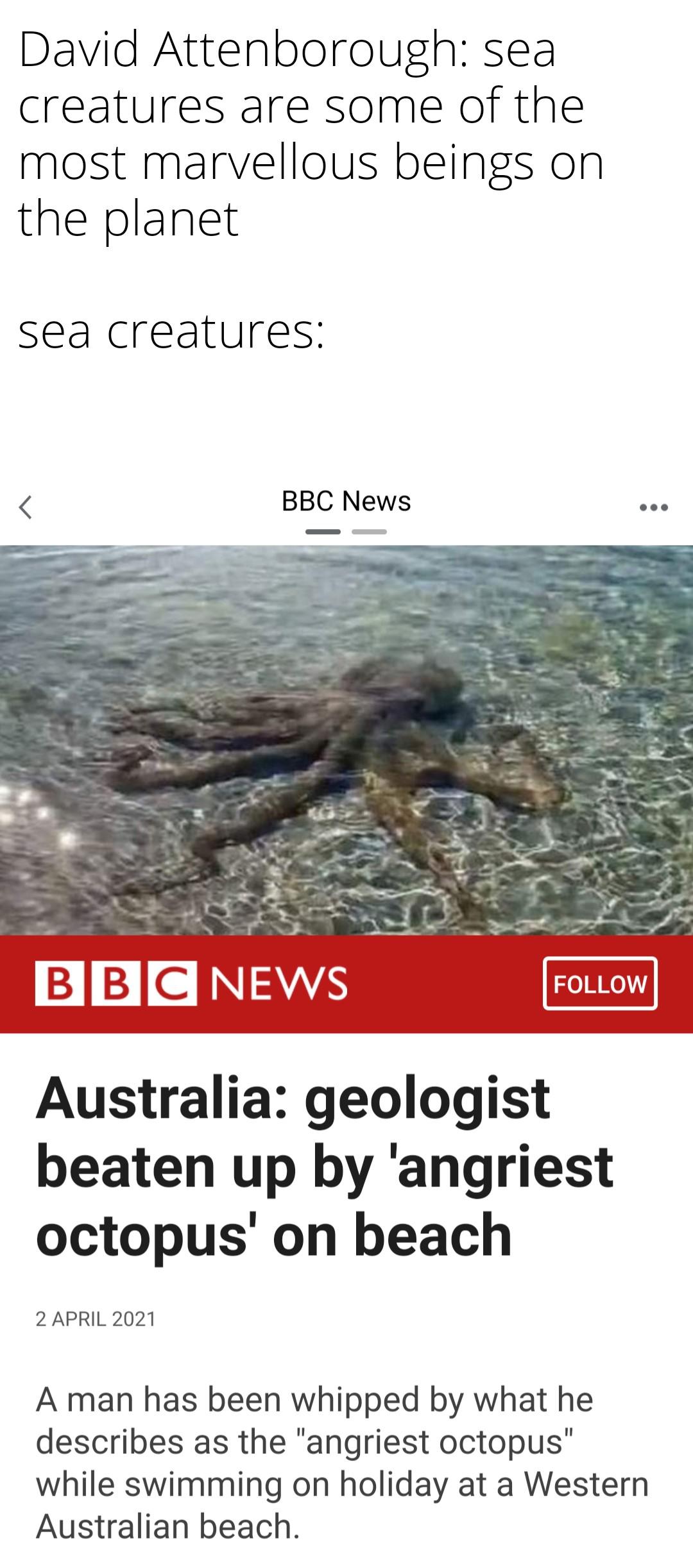 This beats any shark attack. | Scrolller